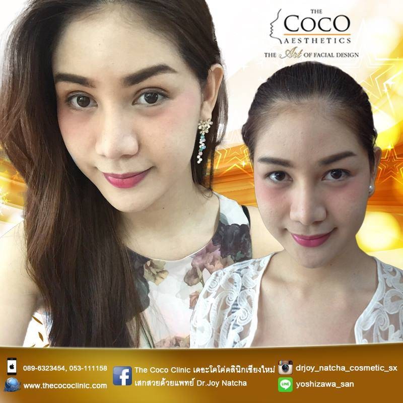 รูป The Coco Clinic เดอะโคโค่คลินิก เชียงใหม่ - Wongnai