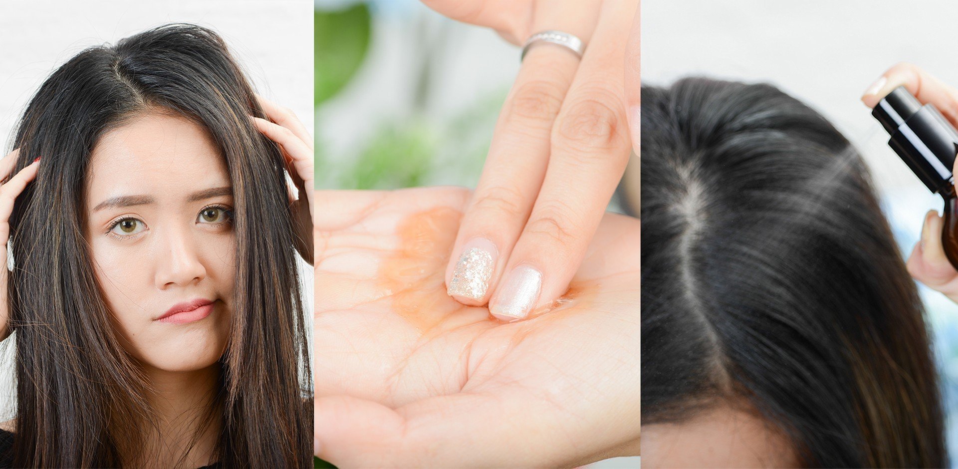 หนังศีรษะแห้ง รังแคถามหา แก้ไขยังไงมาดู