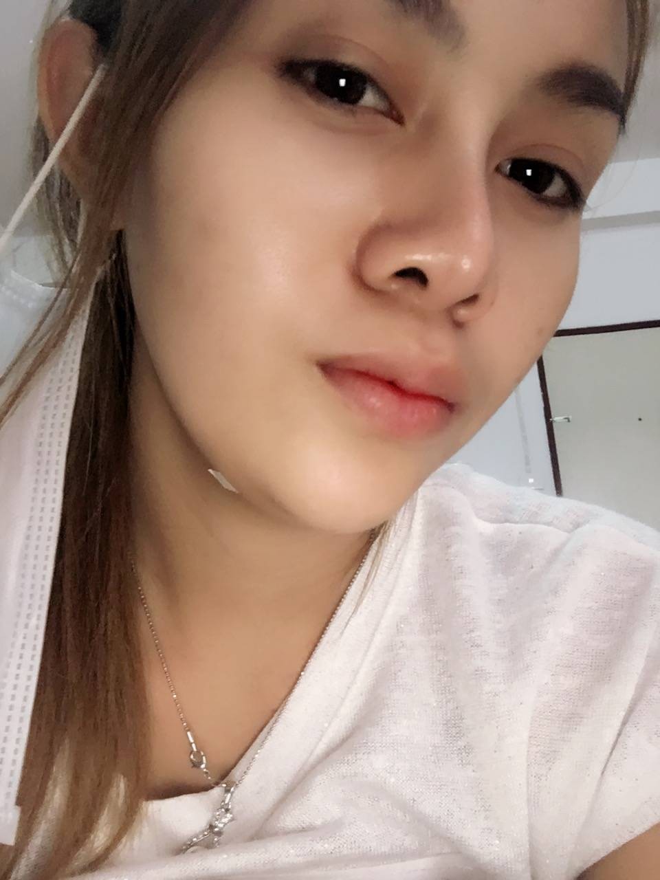 รีวิว V Square Clinic Botox Filler Center Gateway เอกมัย - ร้านสวยสะอาด ...