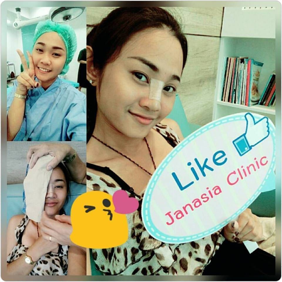 รีวิว Janasia Plastic Surgery (เจเนเชียคลินิก) - Review เสริมจมูก ...