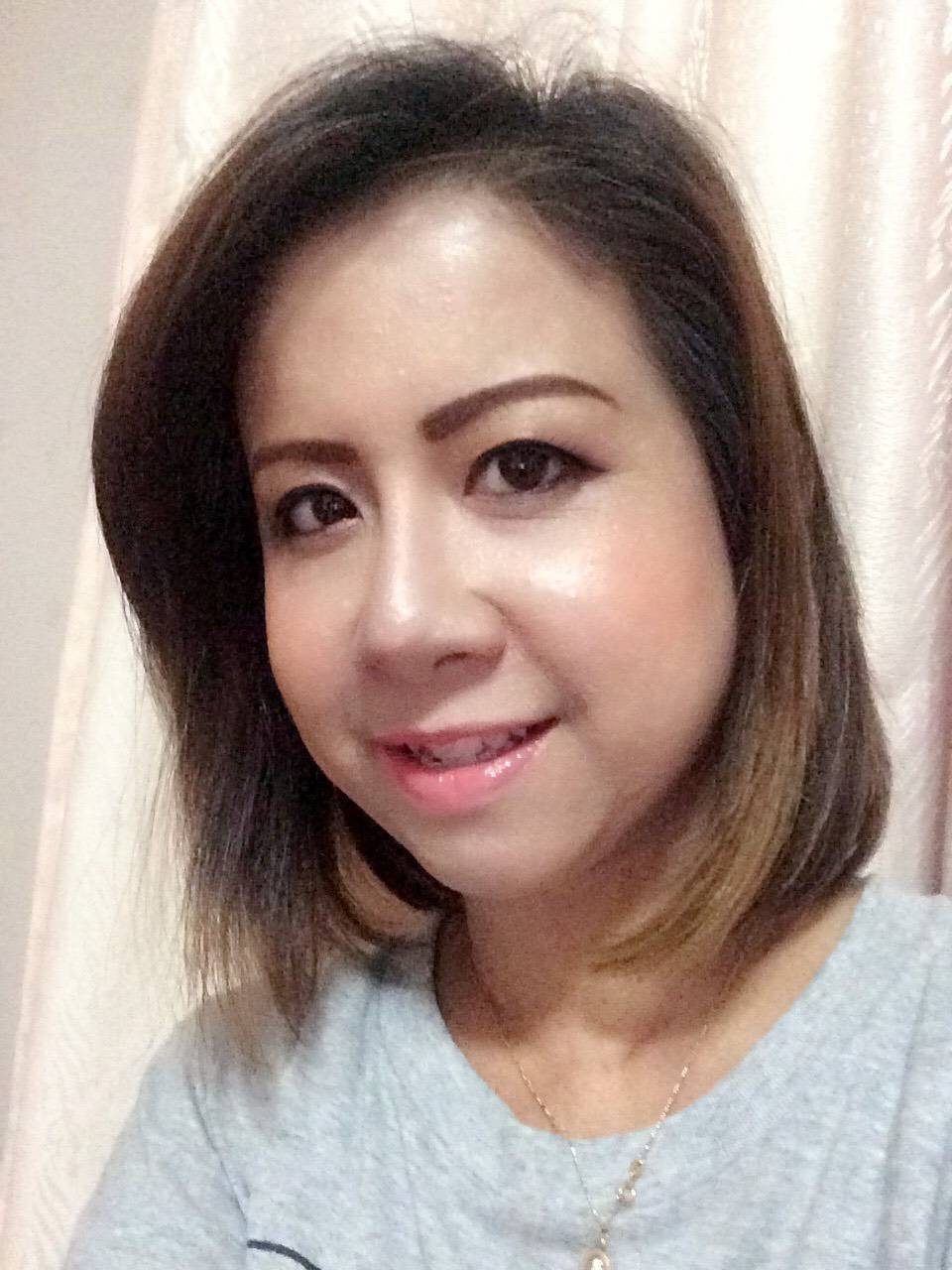 รีวิว Janasia Plastic Surgery (เจเนเชียคลินิก) - ครบ1เดือนกับการดึงขมับ ...