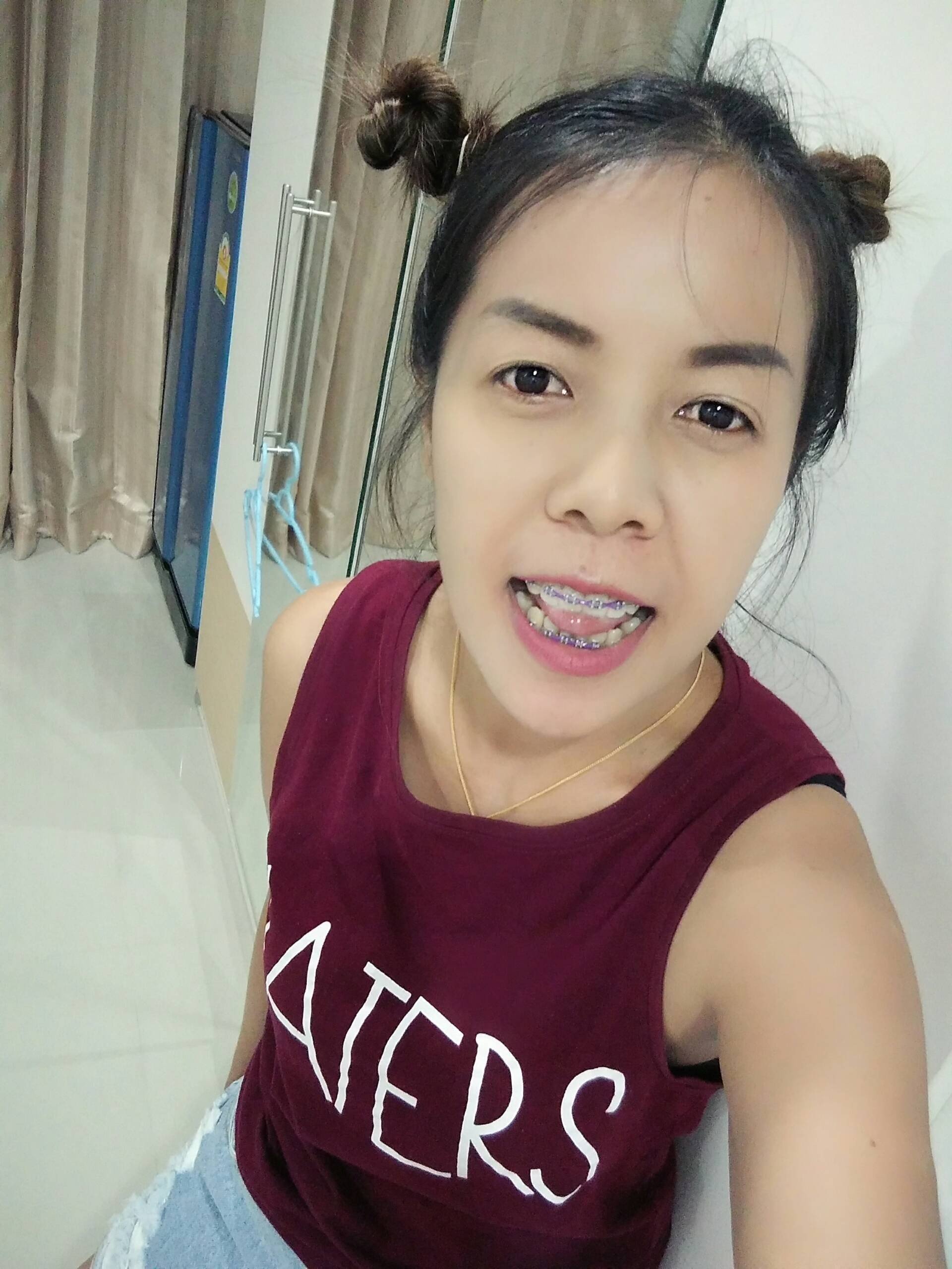 รีวิว V Square Clinic Botox Filler Center Major Ratchayothin - มาทำมาเด ...