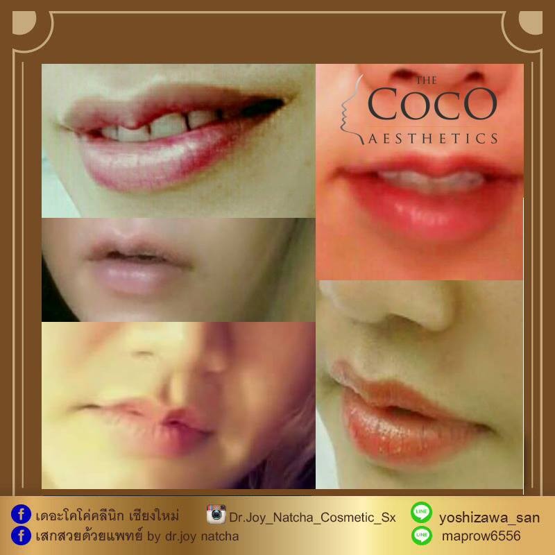 รูป The Coco Clinic เดอะโคโค่คลินิก เชียงใหม่ - Wongnai