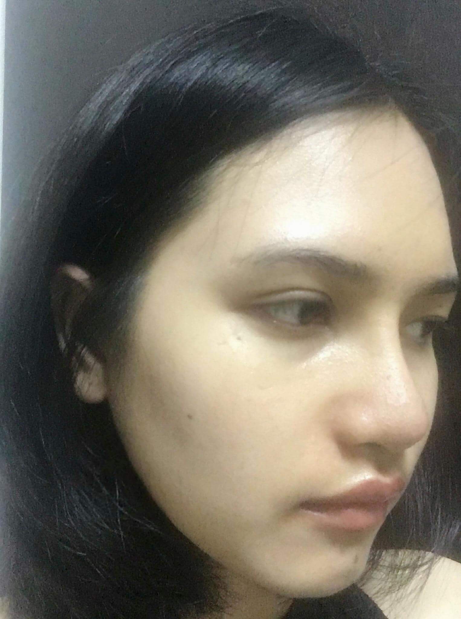 รีวิว Haeyo Clinic - ประทับใจ บริการดีมาก