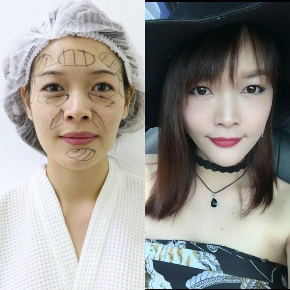 รีวิว Haeyo Clinic - วิตามินผิวที่นี้ คือดีมากคะ - Wongnai