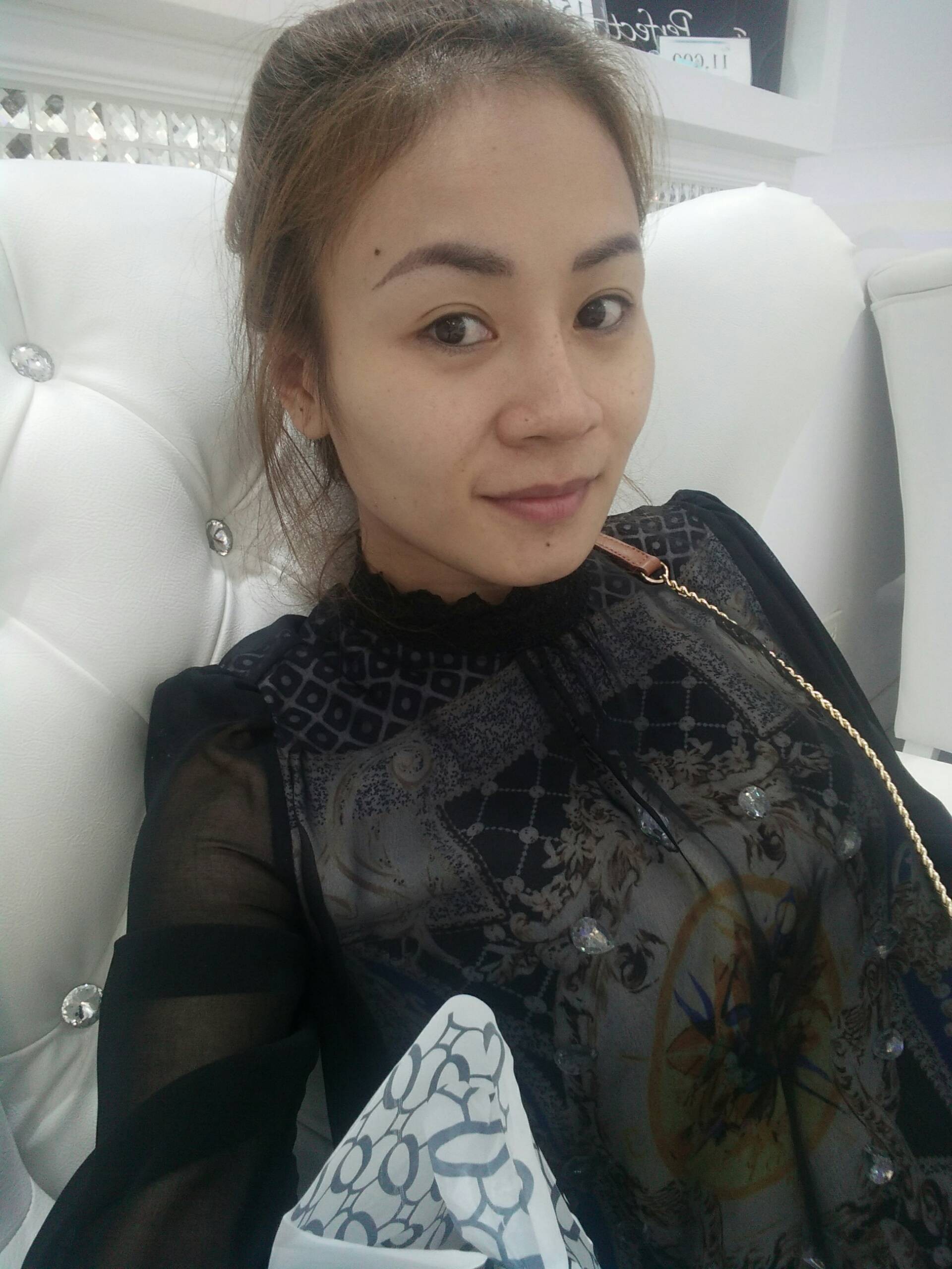 รีวิว V Square Clinic Botox Filler Center Gateway เอกมัย - มาดูผล Botox ...