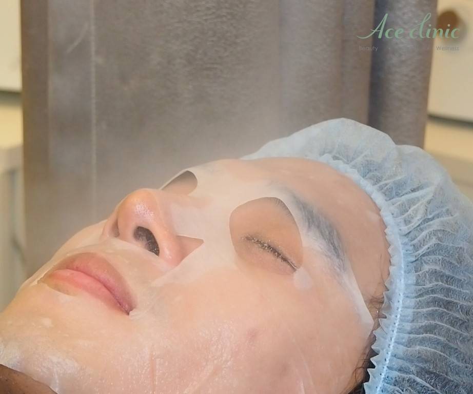 มาส์กและโอโซนเย็น • อโลเวล่าจะซึมเข้าผิวได้เร็วทำให้สดชื่นและผ่อนคลาย ร้าน ACE CLINIC ห้าง ...