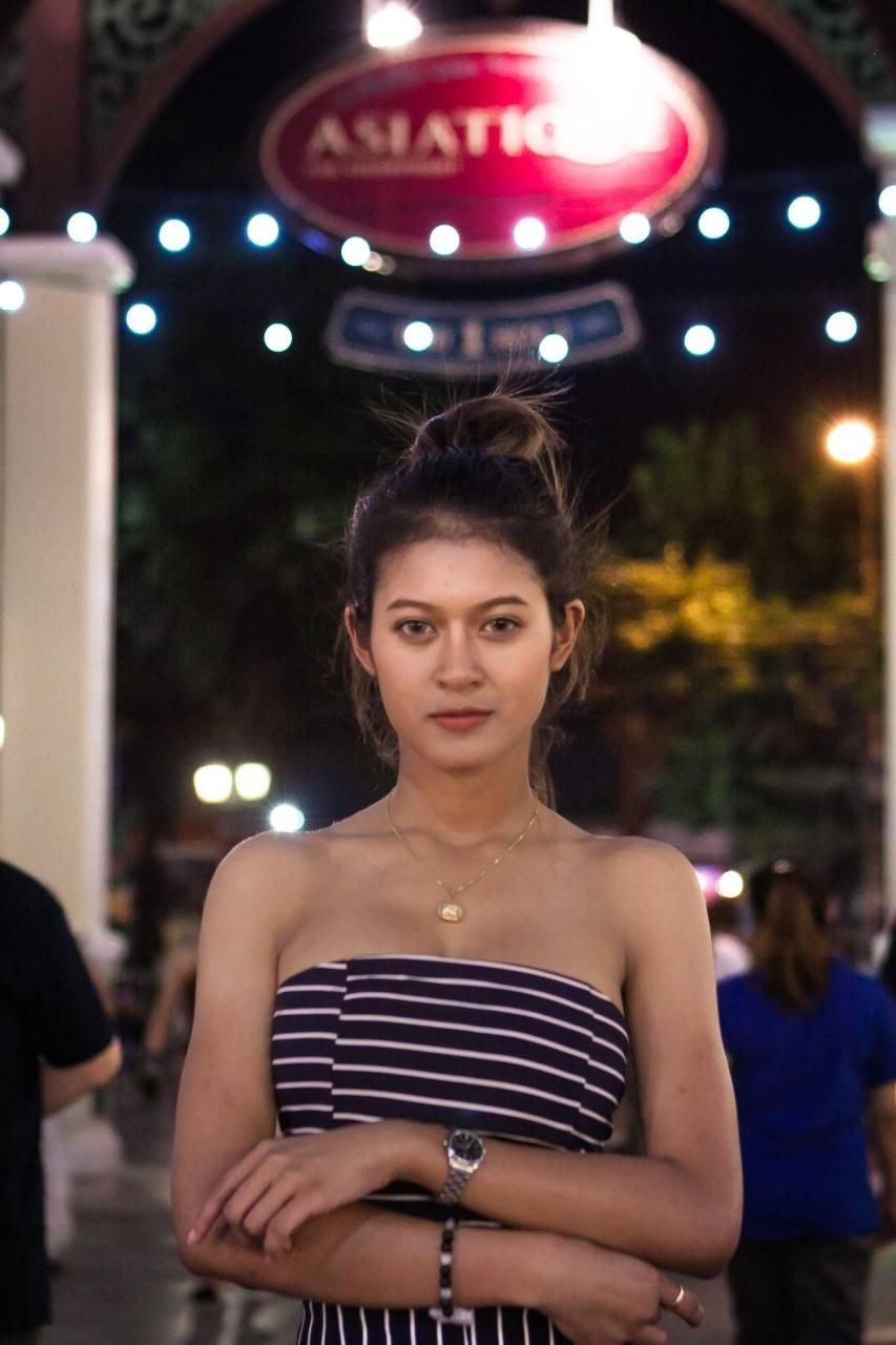 รีวิว Ametise Clinic Sathon Soi 1 - รีวิวแก้จมูก เทคนิคเสริมเนื้อจากก้นกบ