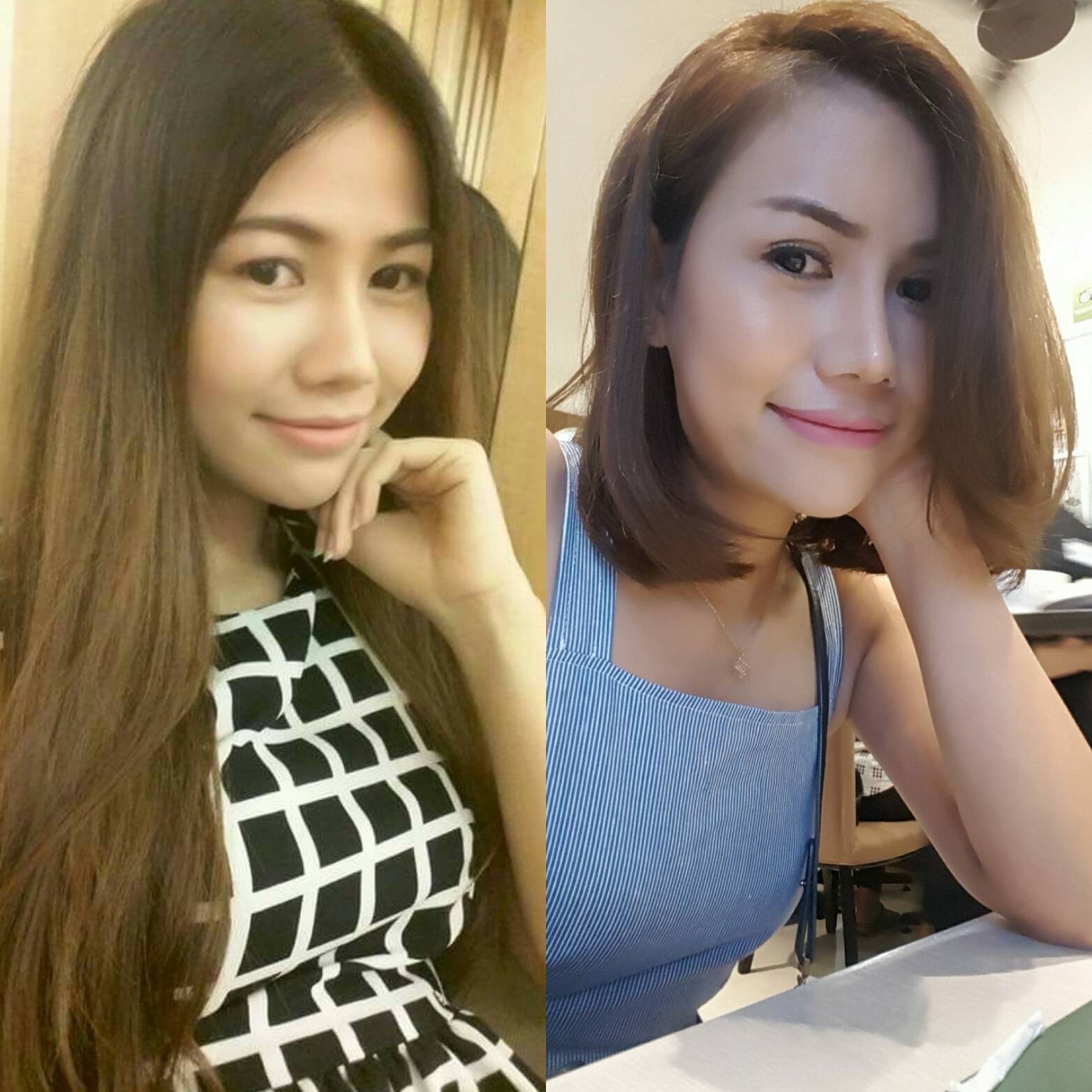 รีวิว SLC Clinics & Hospital - รีวิวศัลยกรรมตา2ชั้น @SLC Hospital