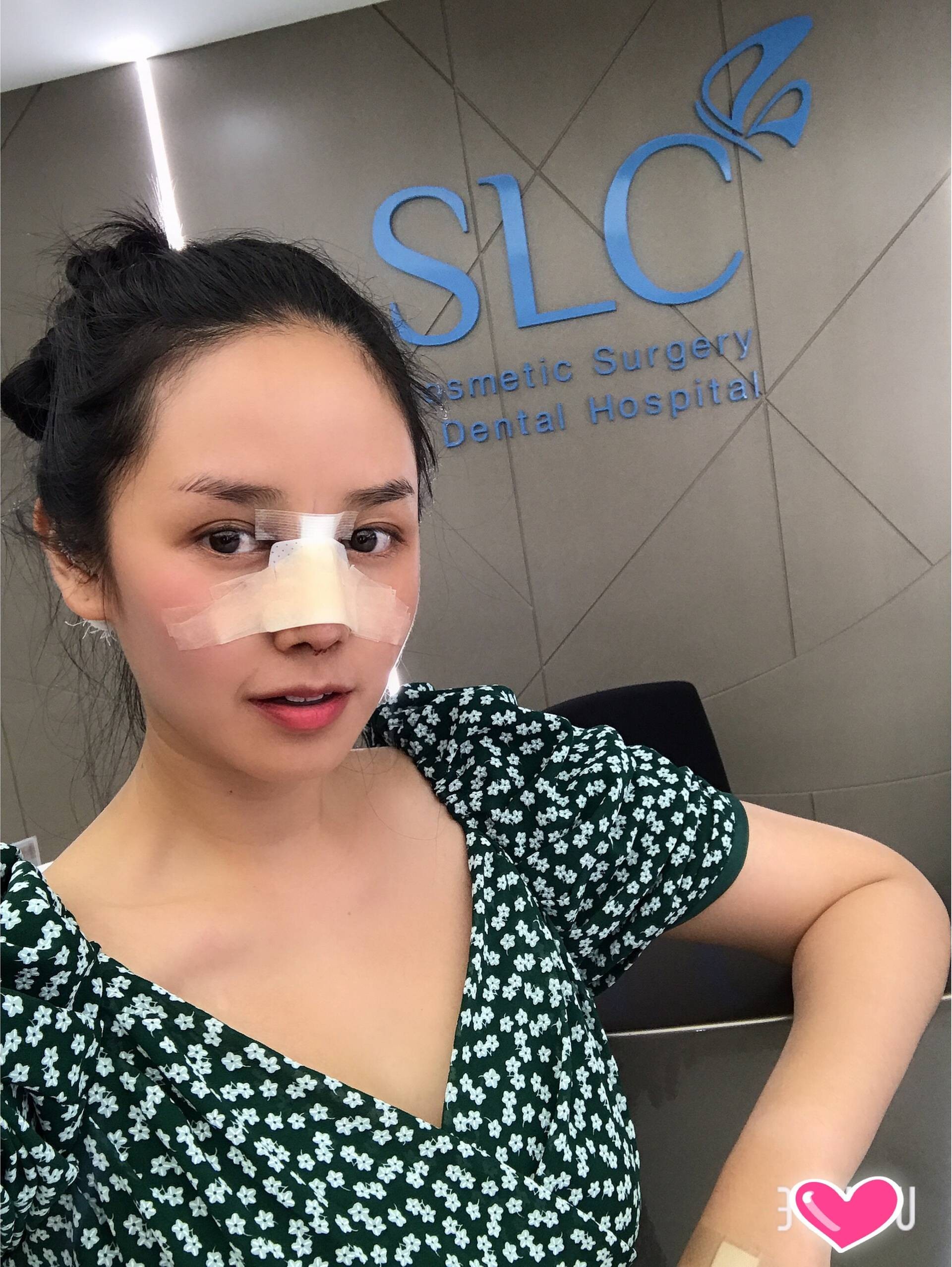 รีวิว โรงพยาบาลศัลยกรรม SLC - วันนี้แวะมาทำแผลค่ะ หน้าจะบวมๆนิดนึงไม่เขียวไม่ช้ำ happy เว่อรวัง 😘