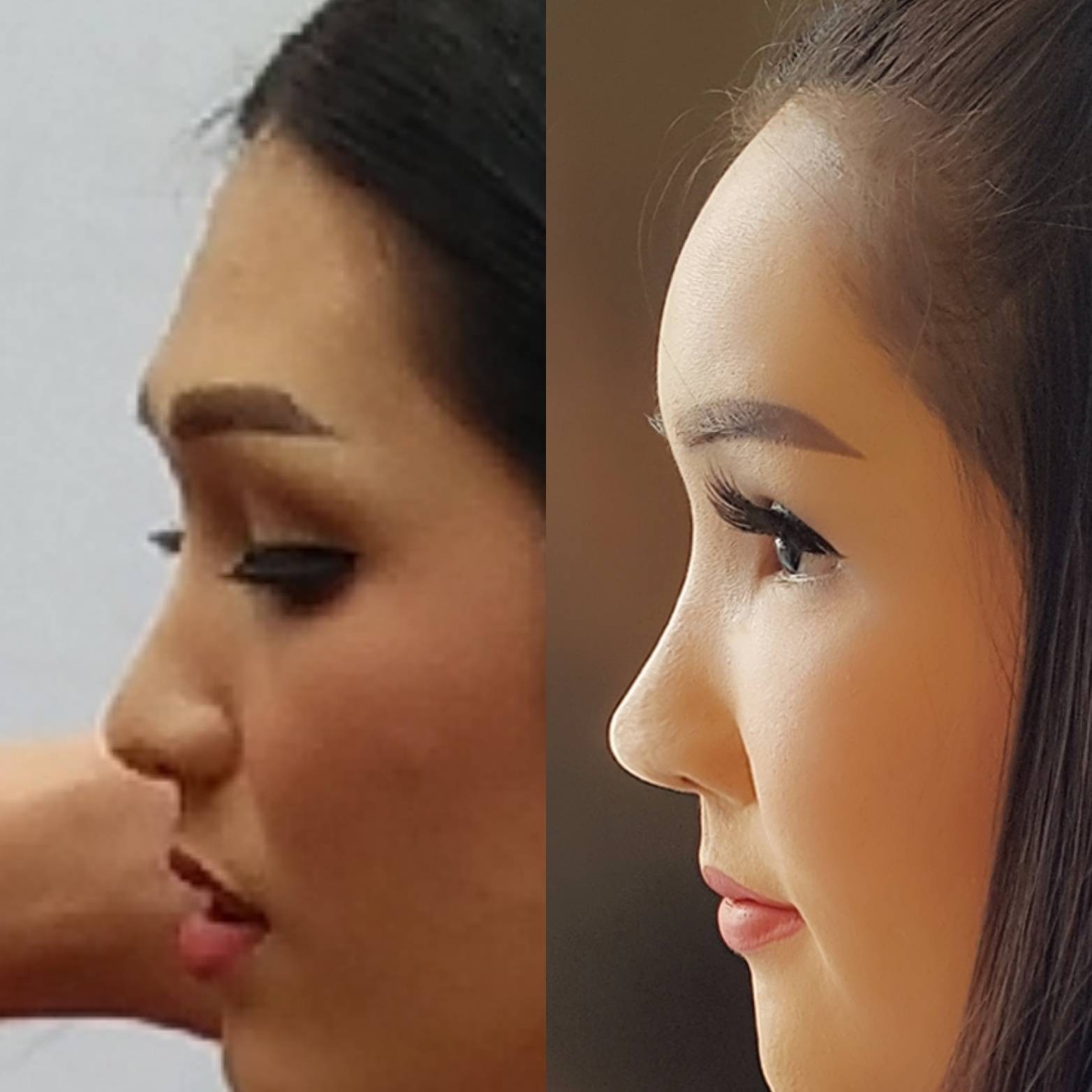 รีวิว โรงพยาบาล SLC - - Wongnai