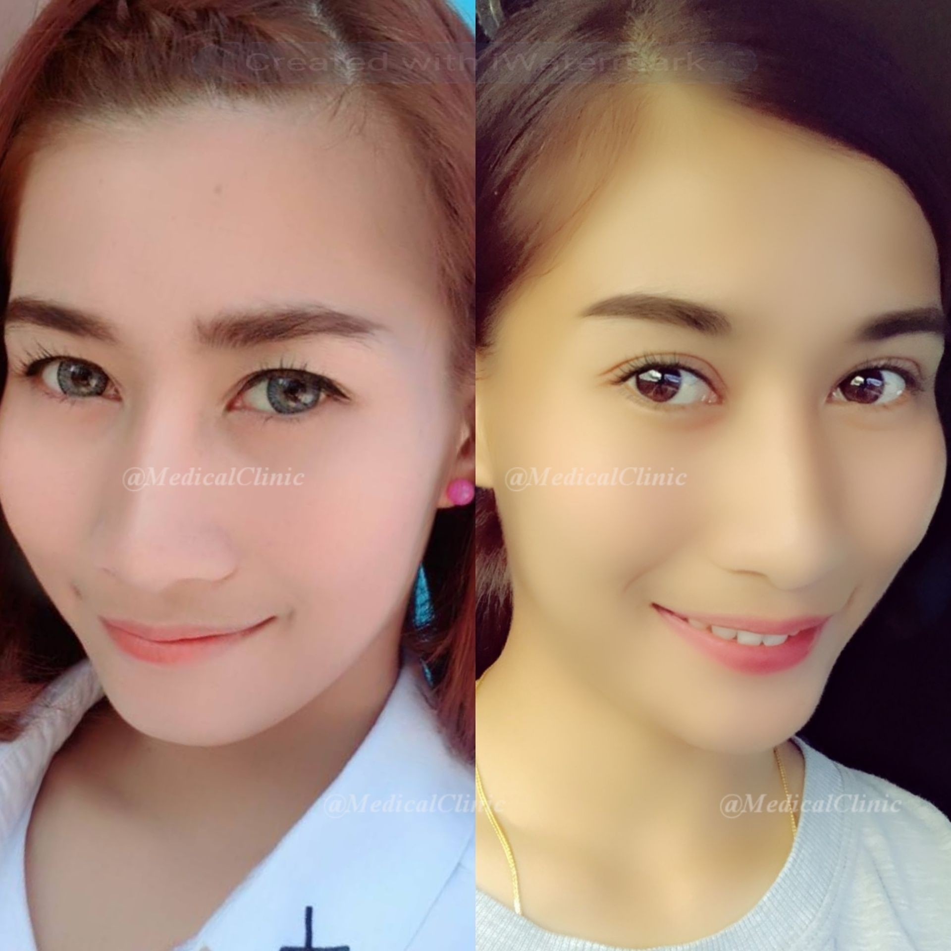 รีวิว At Medical Clinic สาขาฟิวเจอร์พาร์ครังสิต ฟิวเจอร์ พาร์ค รังสิต ...