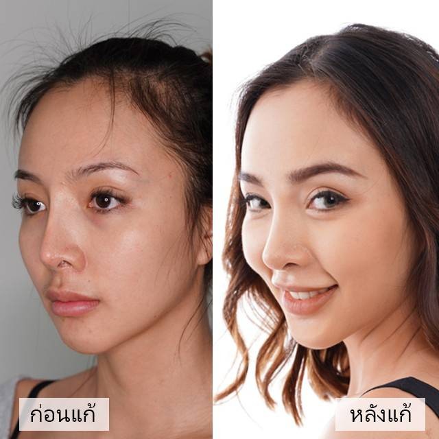 รูป Meko Clinic จตุจักร - Wongnai