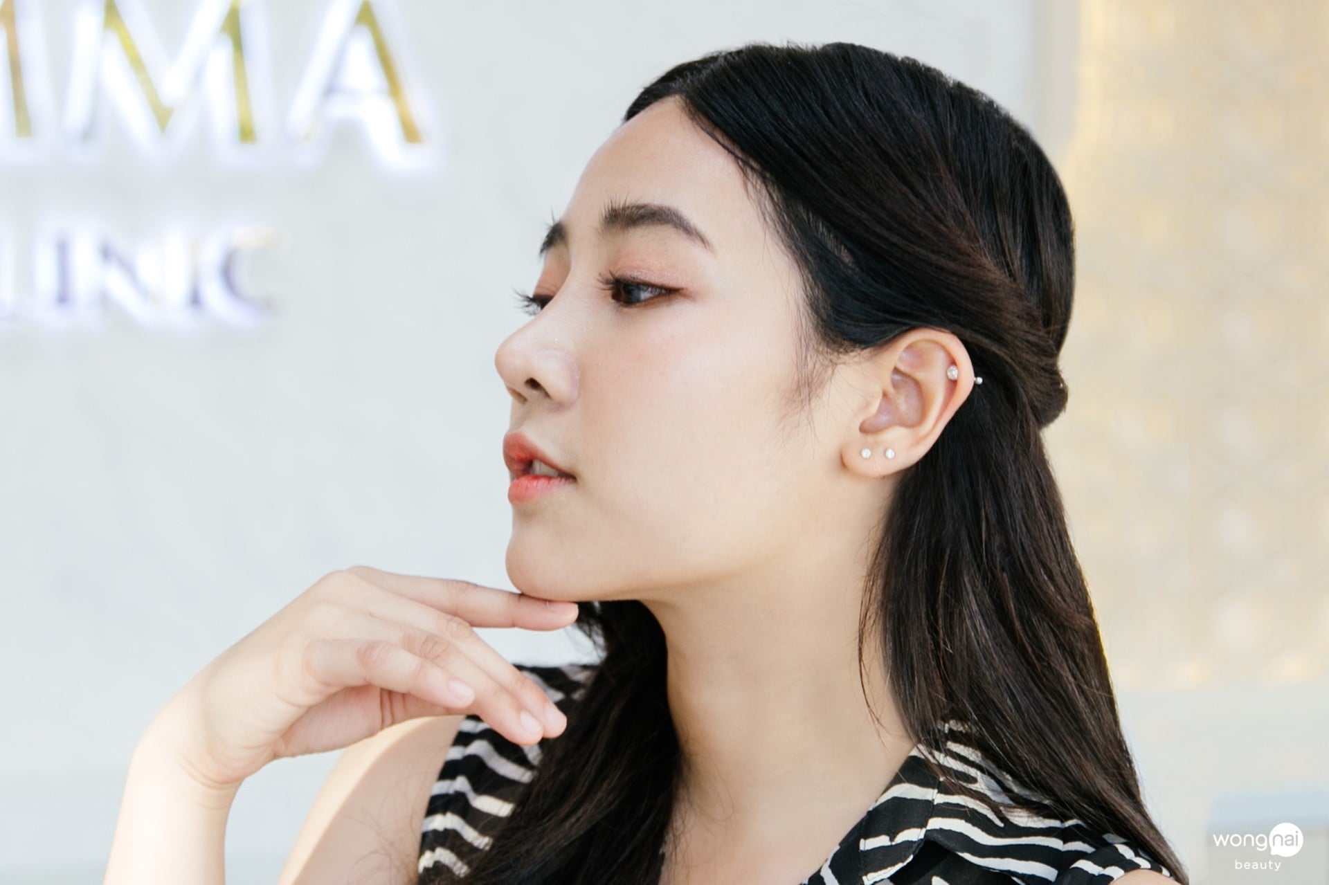 รีวิว “จมูกหยดน้ำ” สวยละมุนแบบผู้ดี ที่ Emma Clinic