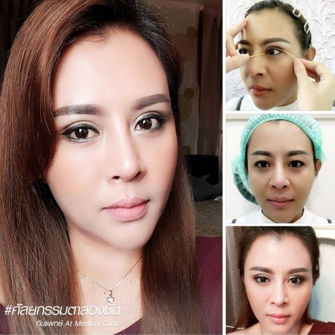 รีวิว At Medical Clinic สาขาฟิวเจอร์พาร์ครังสิต ฟิวเจอร์ พาร์ค รังสิต ...