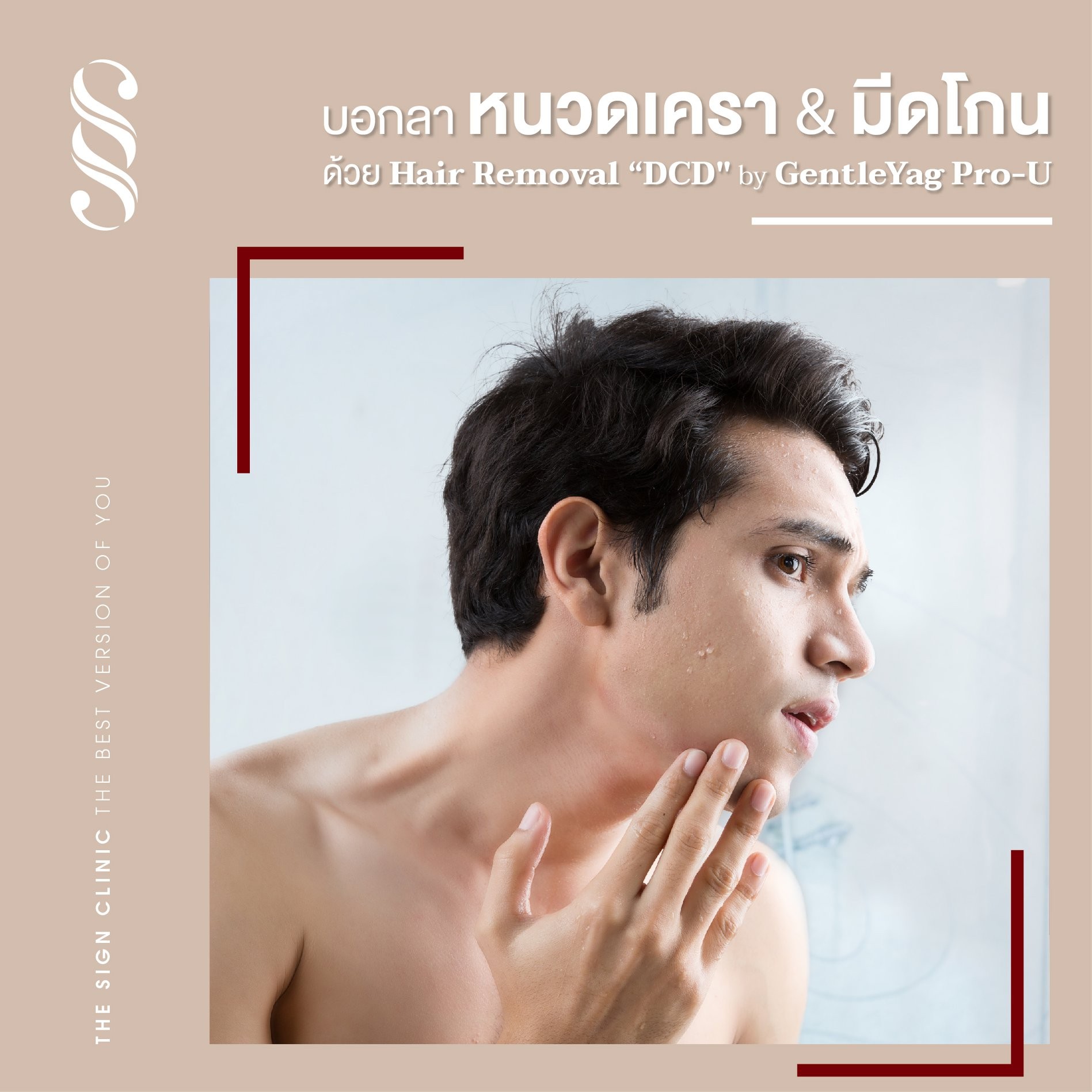 ดีลส่วนลดพิเศษร้าน THE SIGN กำจัดขนหนวด ด้วยเครื่อง GentleYag Pro-U ...