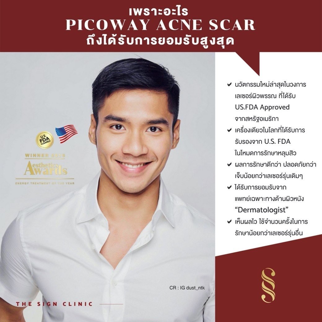 ดีลส่วนลดพิเศษร้าน THE SIGN PicoWay Acne Scar Laser + Subcision 3 sessions ราคาปกติ 75,000 บาท ...