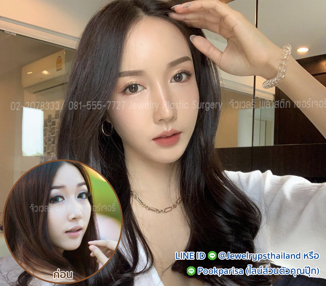 ตอบโจทย์ทุกความสวย รู้จัก Plastic Designer ที่ปรึกษาด้านศัลยกรรมเกาหลี