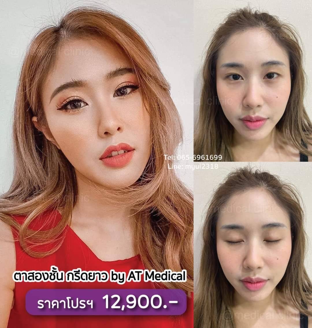 รูป At Medical Clinic สาขาฟิวเจอร์พาร์ครังสิต ฟิวเจอร์ พาร์ค รังสิต ...