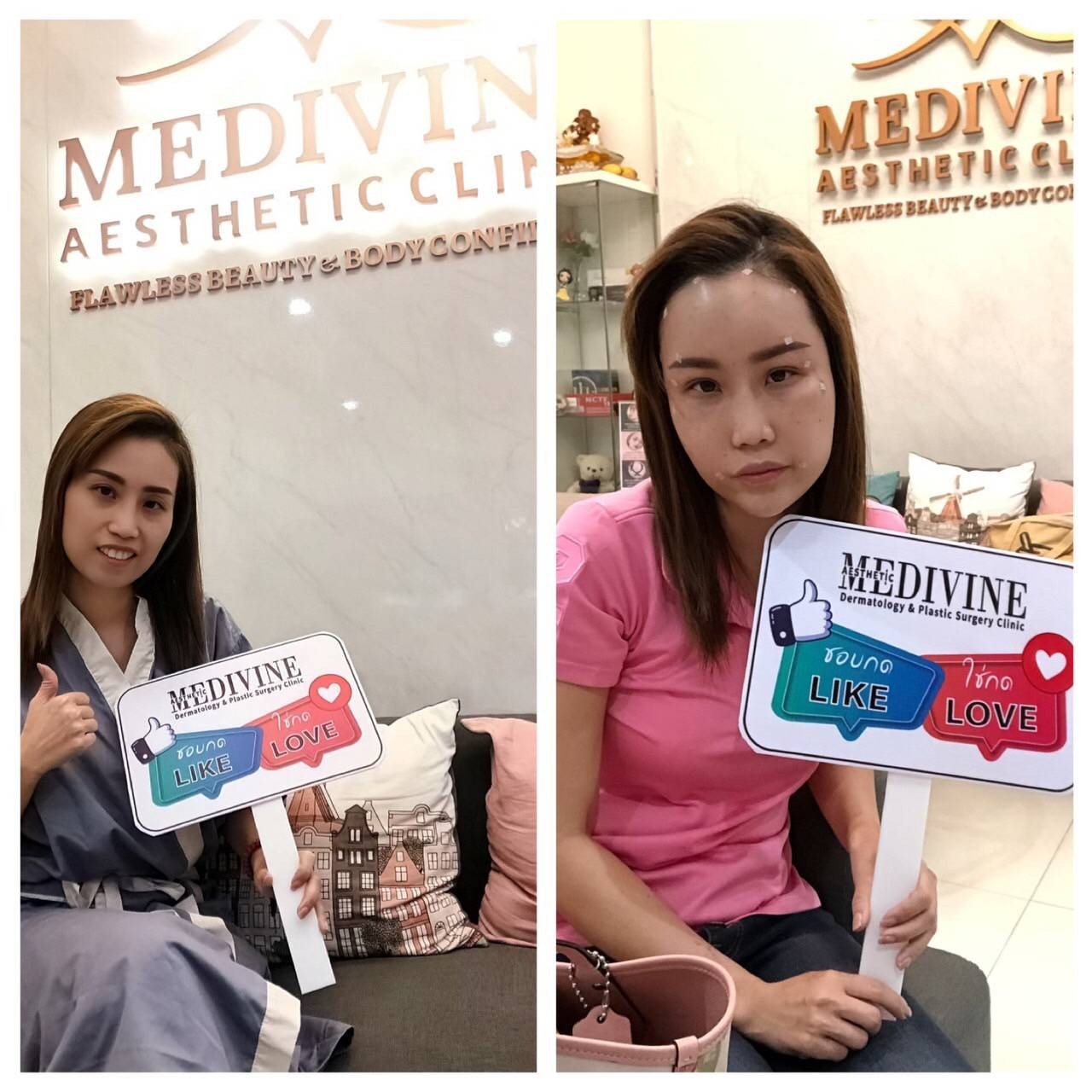 รีวิว Medivine Clinic - เติมไขมันหน้าเด็กกับคุณหมอฟู่ - Wongnai