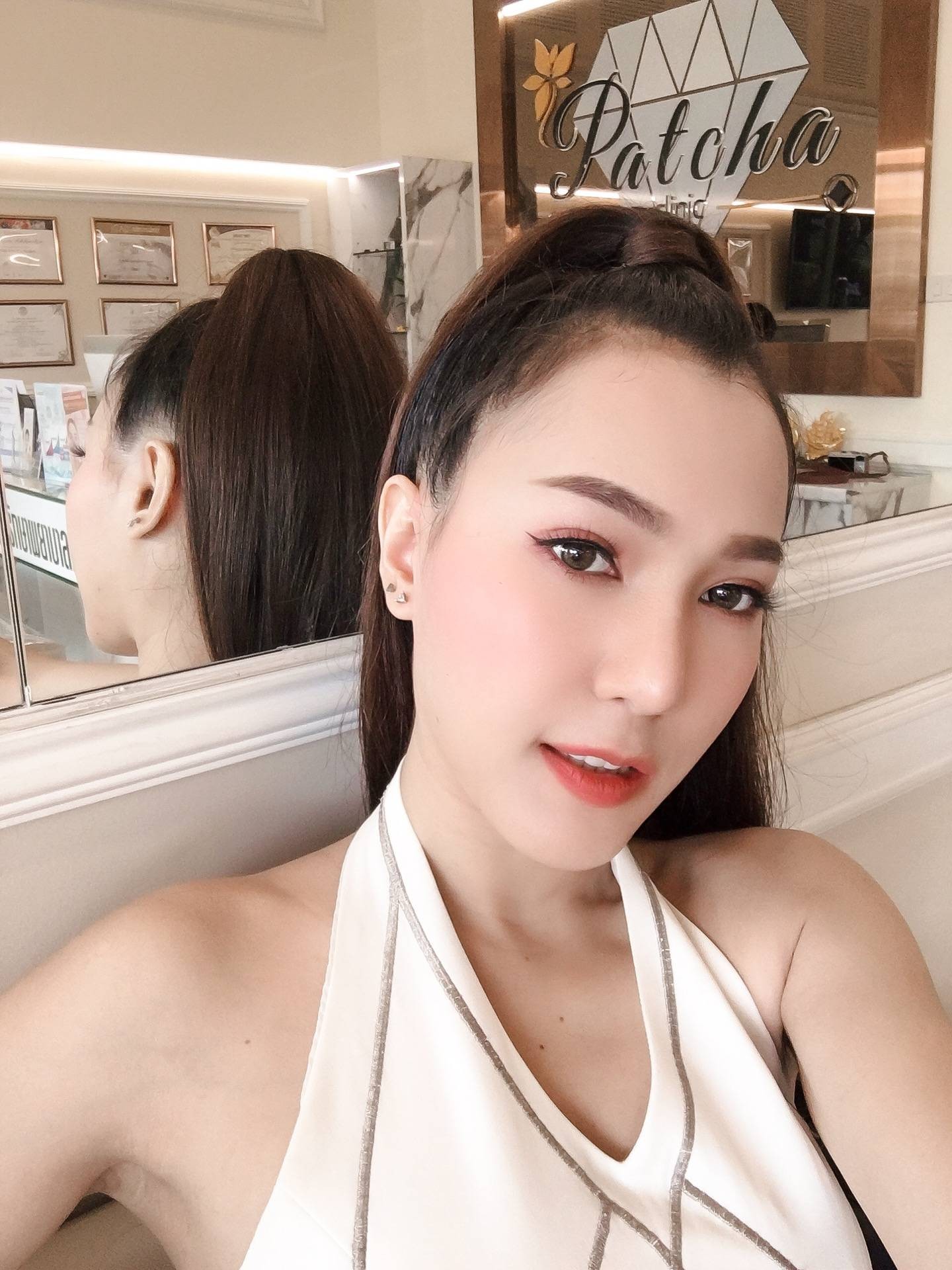 รีวิว Patcha Clinic ร้อยไหม โบท็อกซ์ ฟิลเลอร์ - อัพความสวยที่นี่