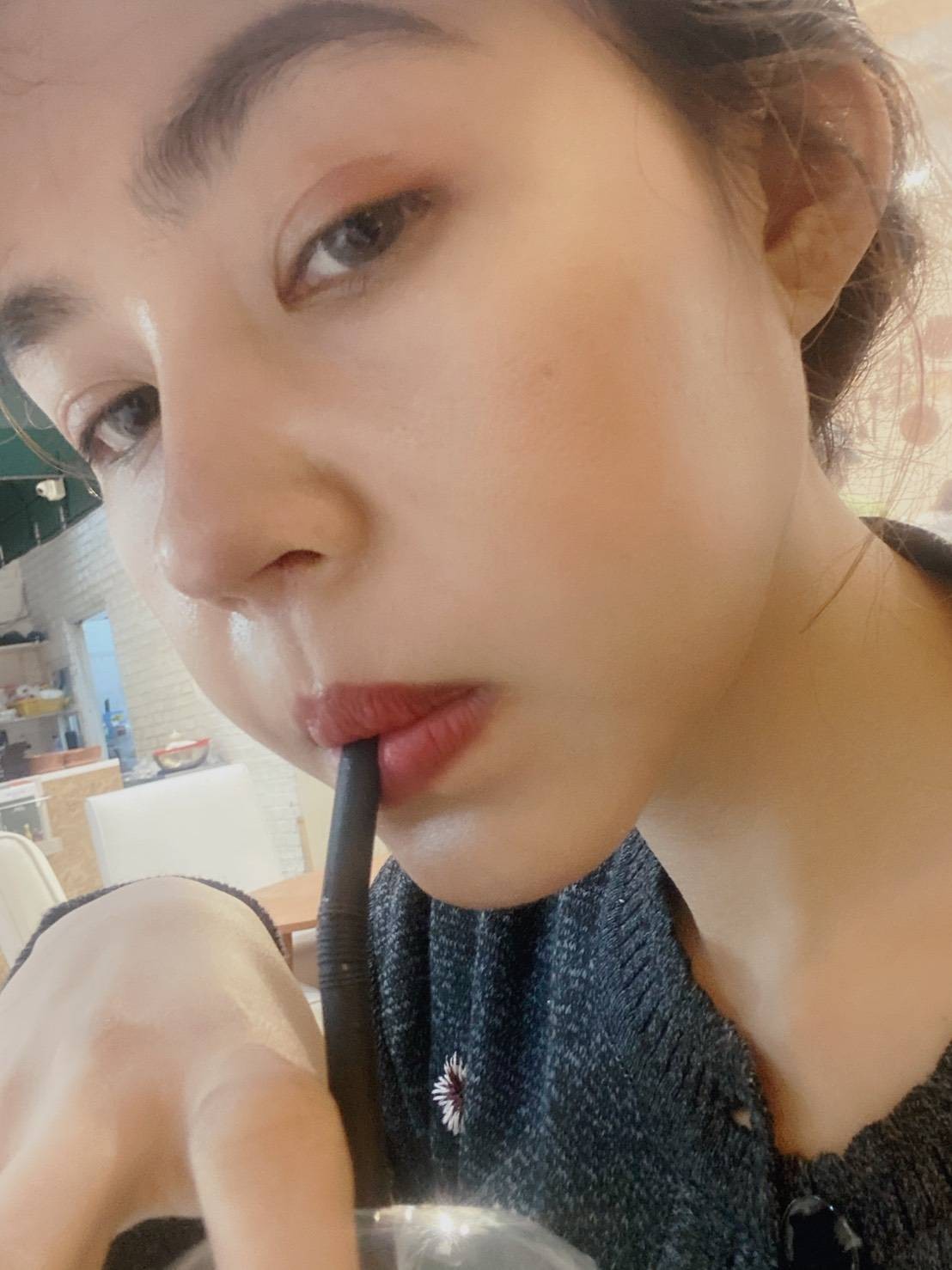 ศัลยกรรมจมูก • หลังทำ 7 วัน มาตัดไหมแผลแบบกริบมาก แทบมองไม่เห็น ปลื้ม ร้าน Doctor Kusol Avenue ...