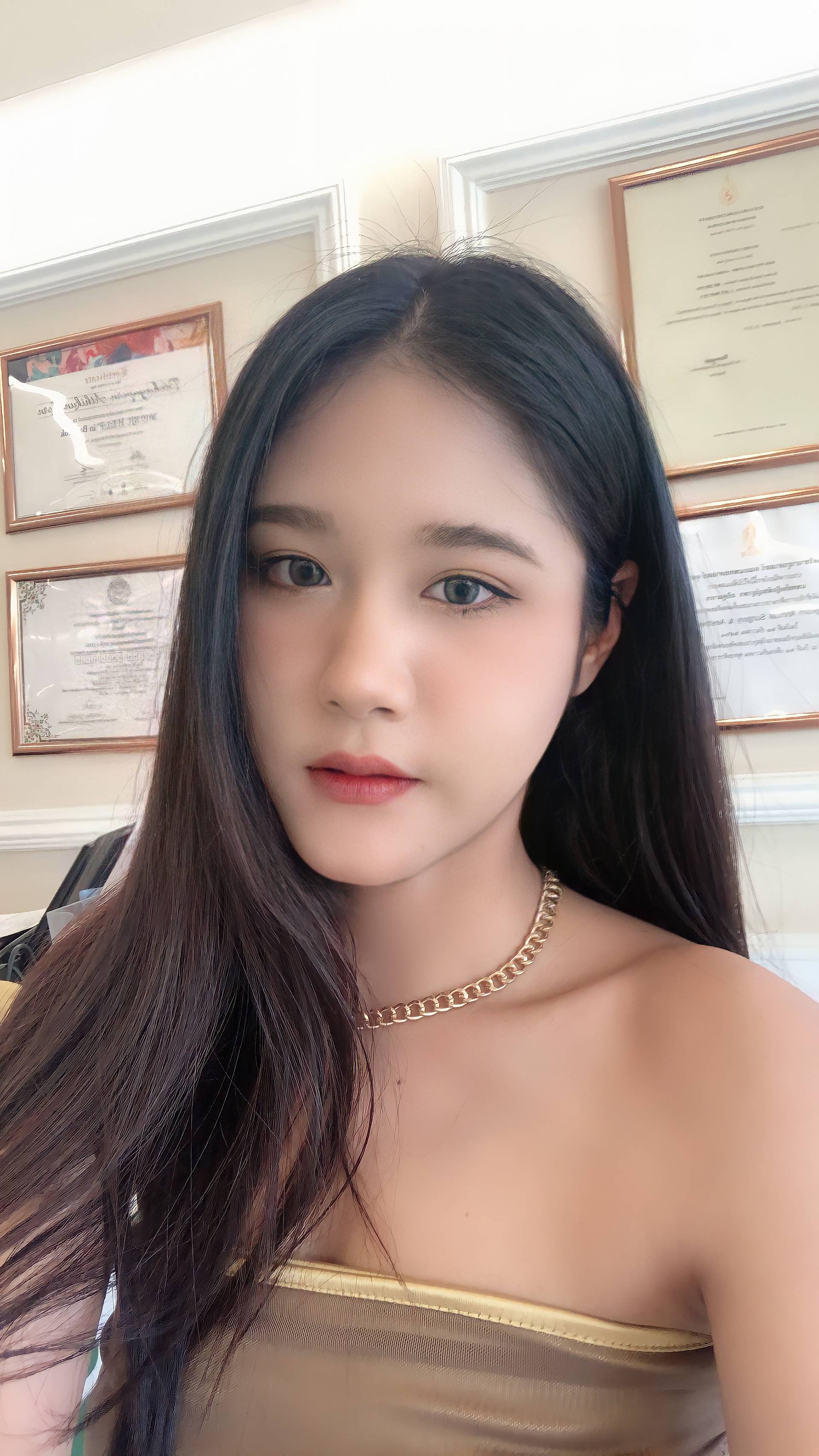 รีวิว Patcha Clinic ร้อยไหม โบท็อกซ์ ฟิลเลอร์ - มาฉีดแฟตแก้มที่นี่ค่ะ