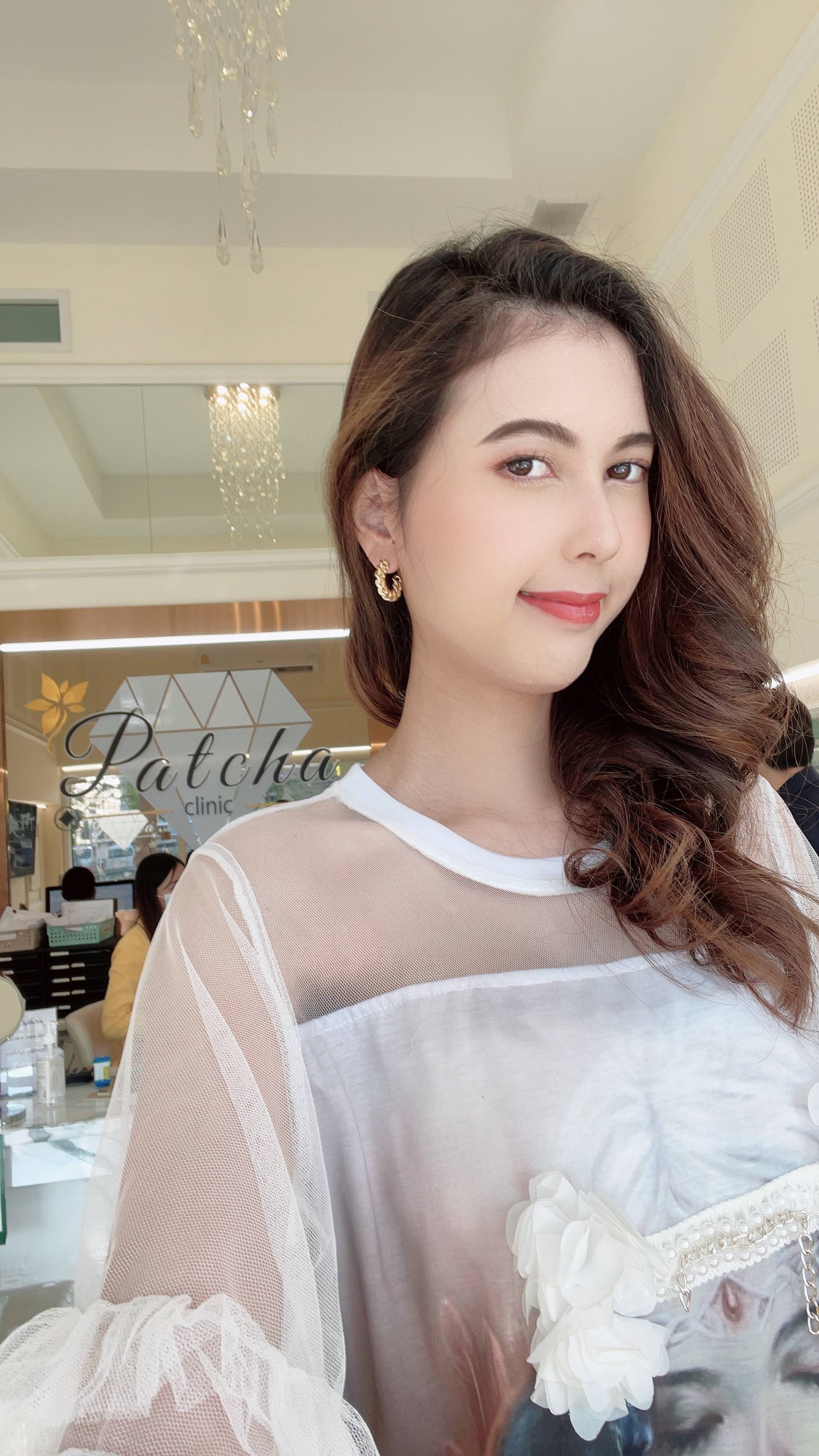 รีวิว Patcha Clinic ร้อยไหม โบท็อกซ์ ฟิลเลอร์ - พอใจในบริการเมโสแฟต