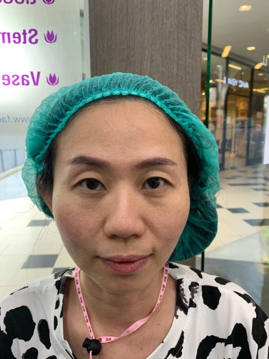 รีวิว At Medical Clinic สยามสแควร์วัน - เปลี่ยนตาหมวย เป็นตาสวย กับหมอ ...