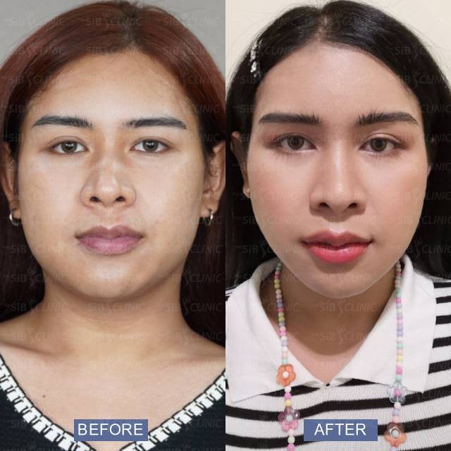 รีวิว The SIB Clinic ทองหล่อ