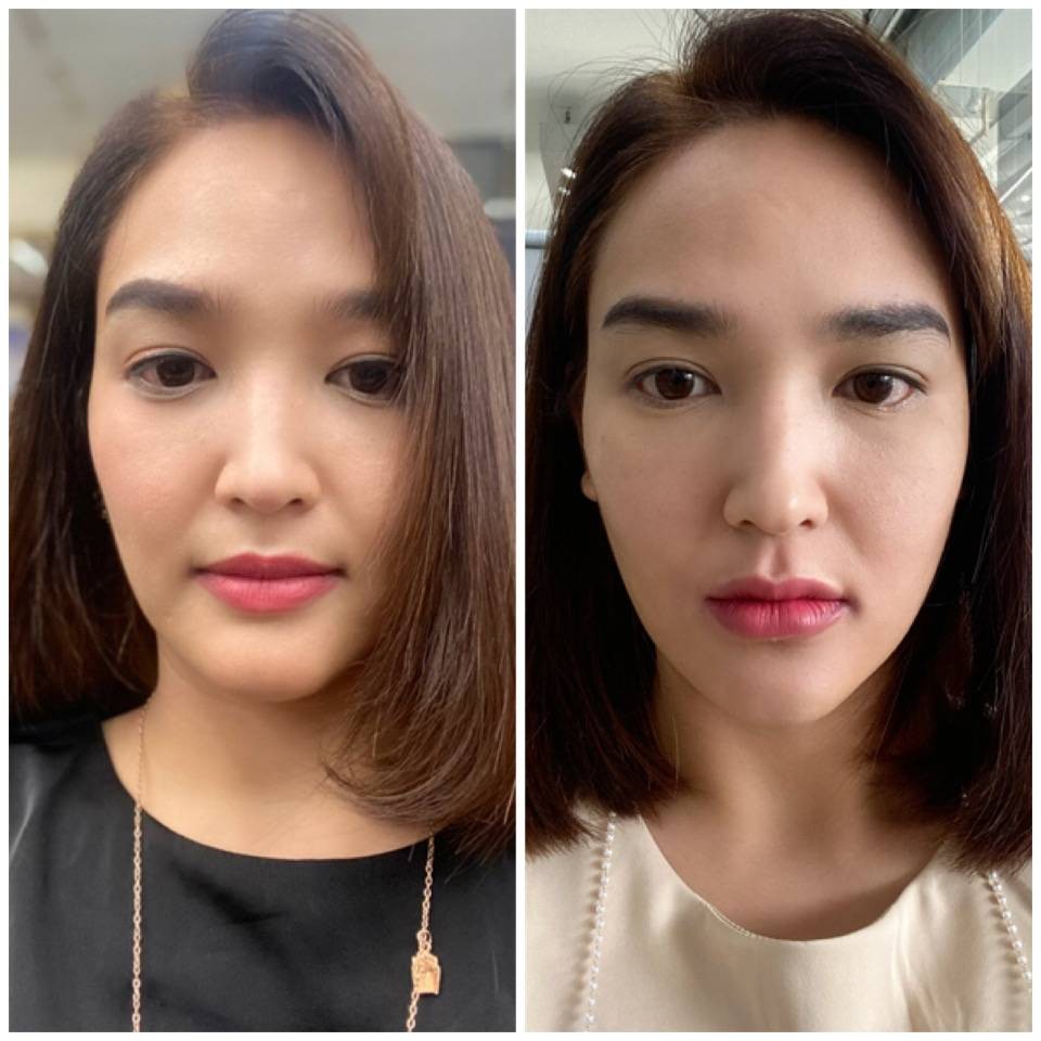 รูป Revize Clinic Rayong