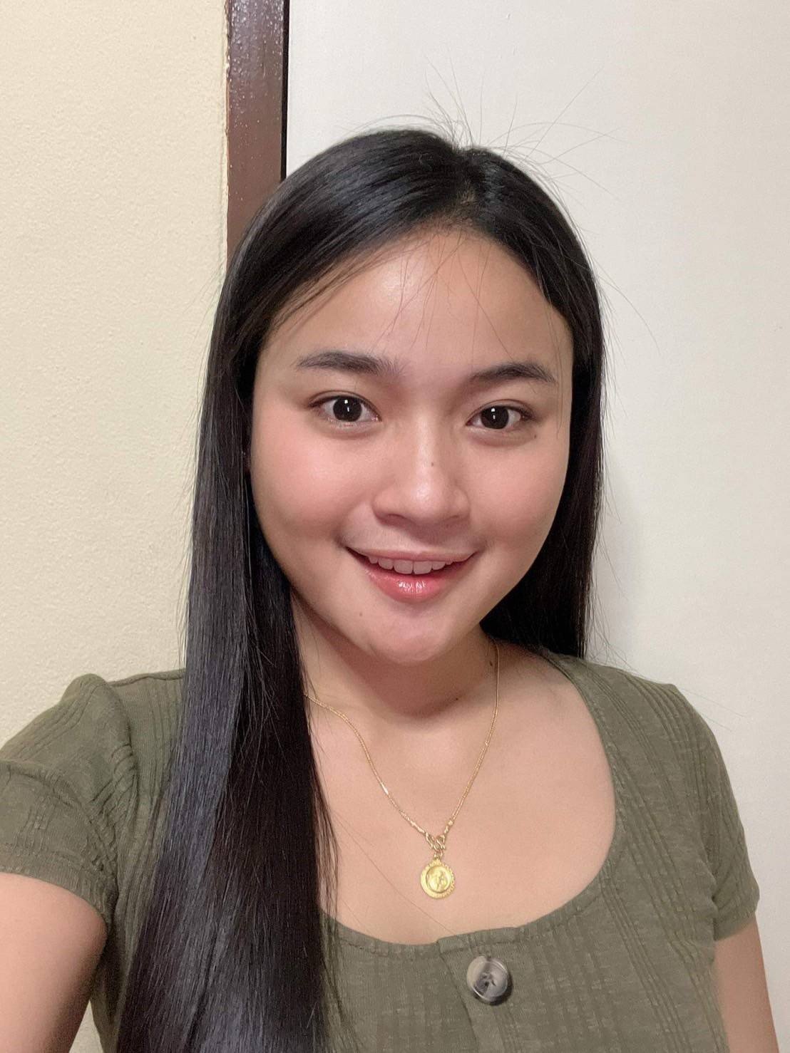 รีวิว U2clinic - อัด Botox ไม่จำกัดยู ที่ U2 clinic หน้าเล็กเรียวจริงไม่จกตา