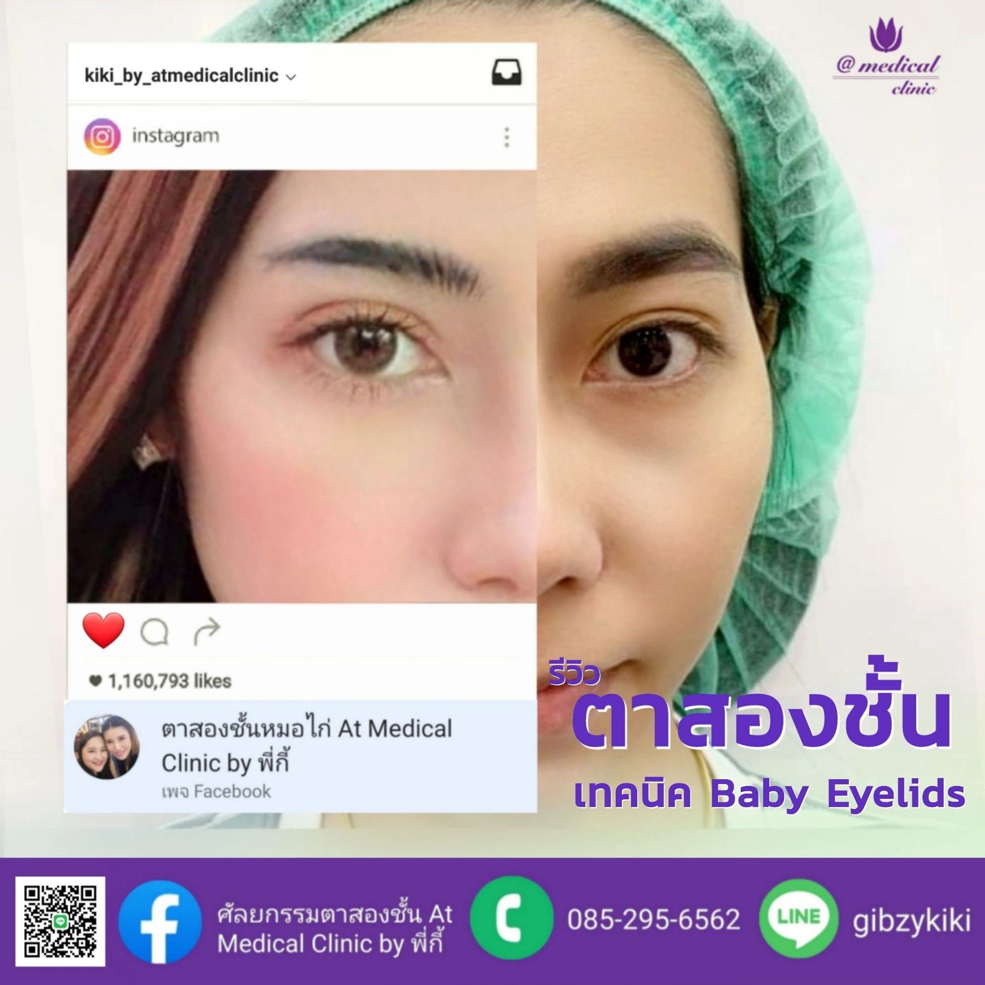 รูป AT Medical Clinic เซ็นทรัลพระราม 2