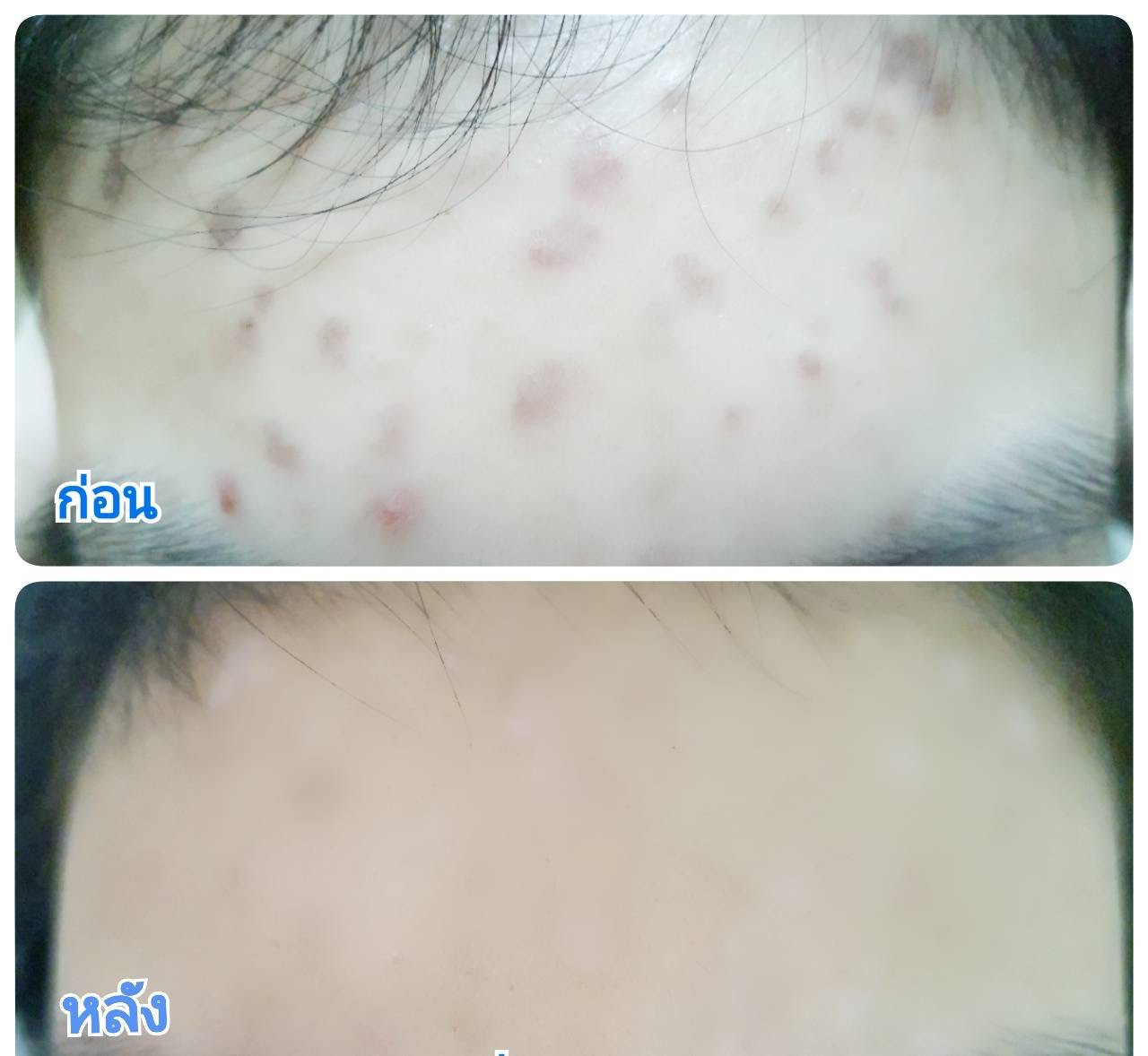 รีวิว Slender Slimming เพิ่มสิน - เหมือนได้เกิดใหม่ เลิกตัดผมหน้าม้าซะ ...