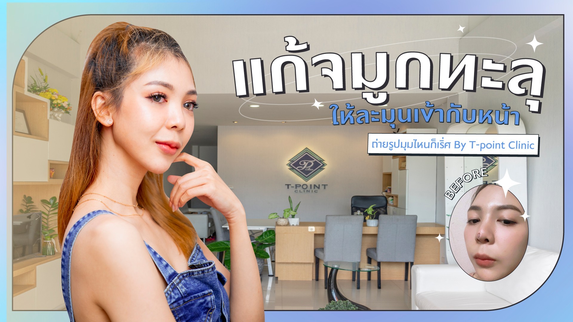 แก้จมูกทะลุ ให้ละมุนเข้ากับหน้า ถ่ายรูปมุมไหนก็เริ่ศ By T-point Clinic