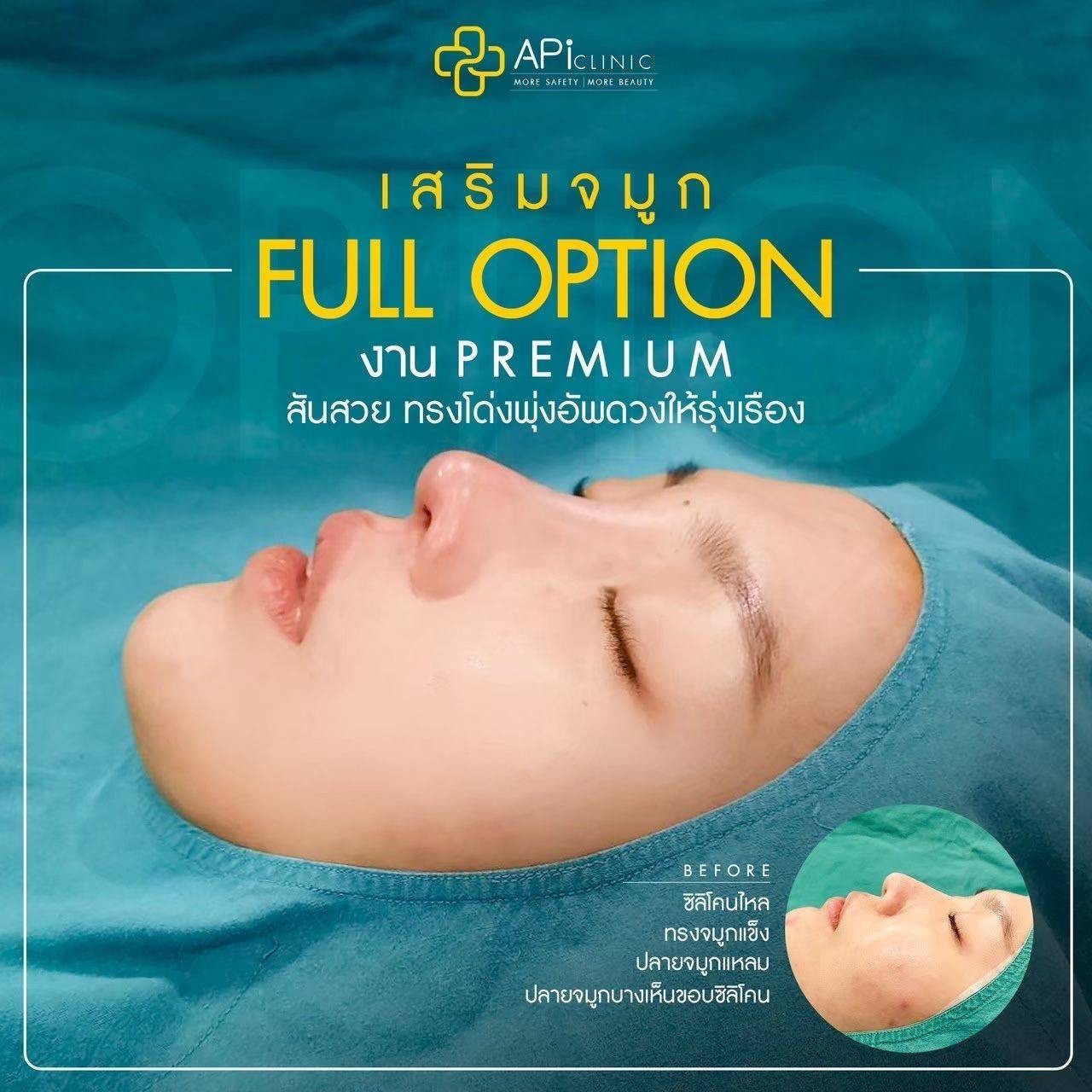 รีวิว APi Clinic เสริมจมูกเทคนิคเกาหลี by หมอต้น AF - เสริมจมูกเทคนิค ...