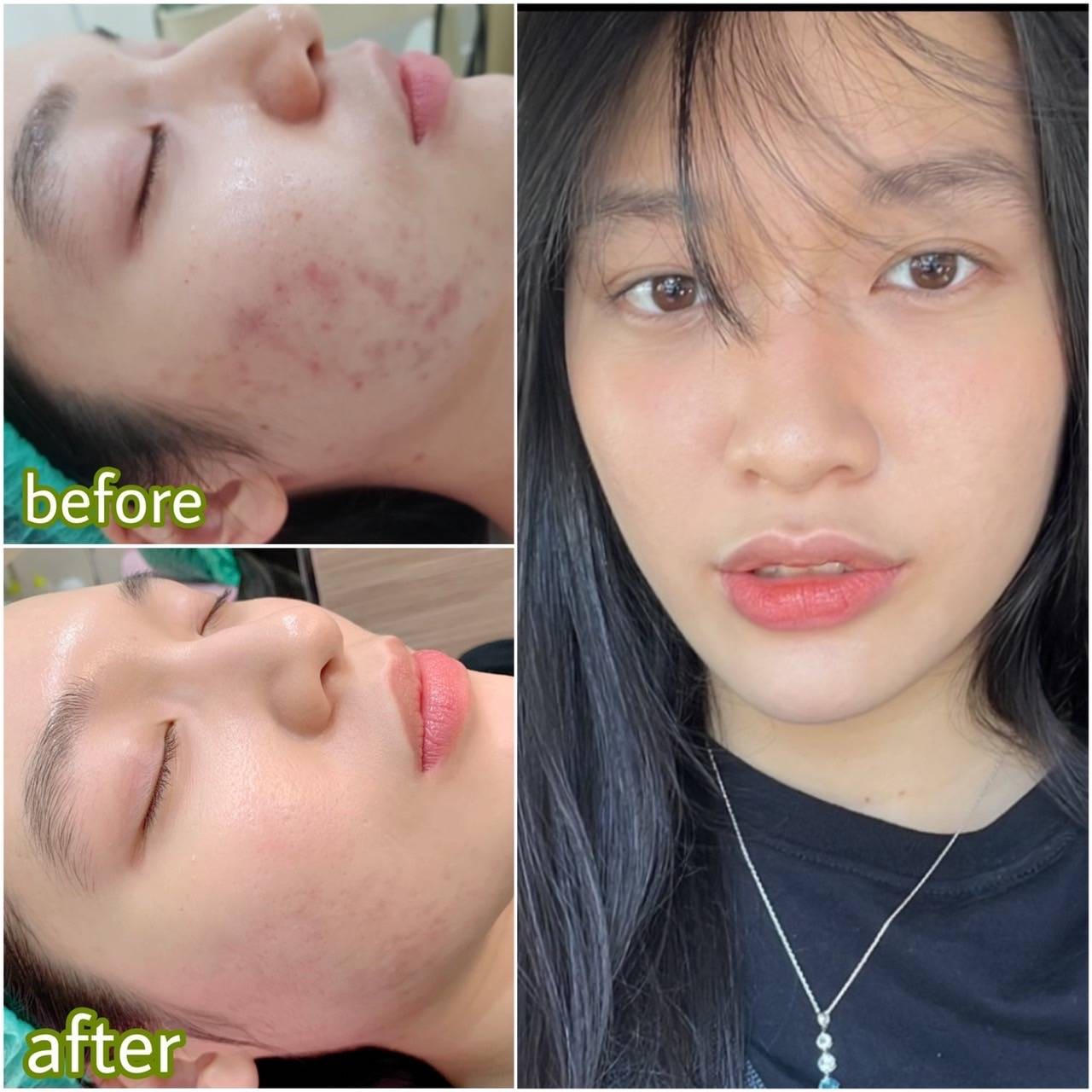 รูป Olivia Clinic สัมมากรเพลส รามคำแหง110 - Wongnai