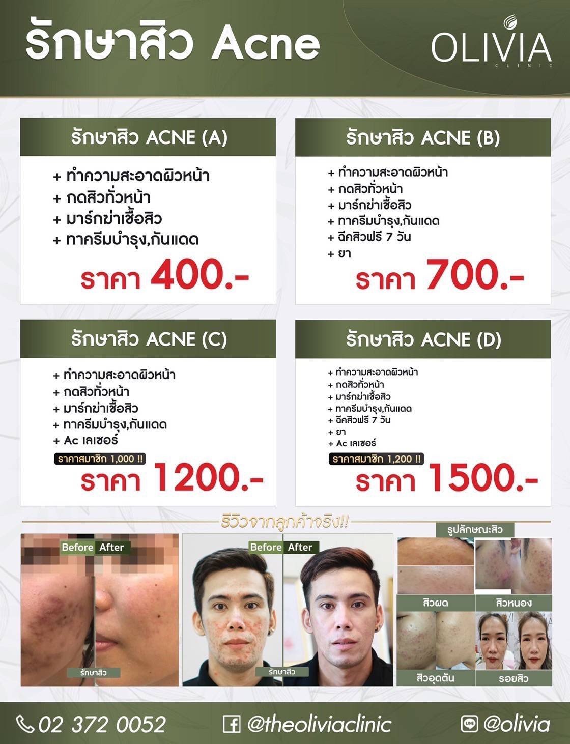 รีวิว Olivia Clinic สัมมากรเพลส รามคำแหง110 - รักษาสิวทั่วหน้า