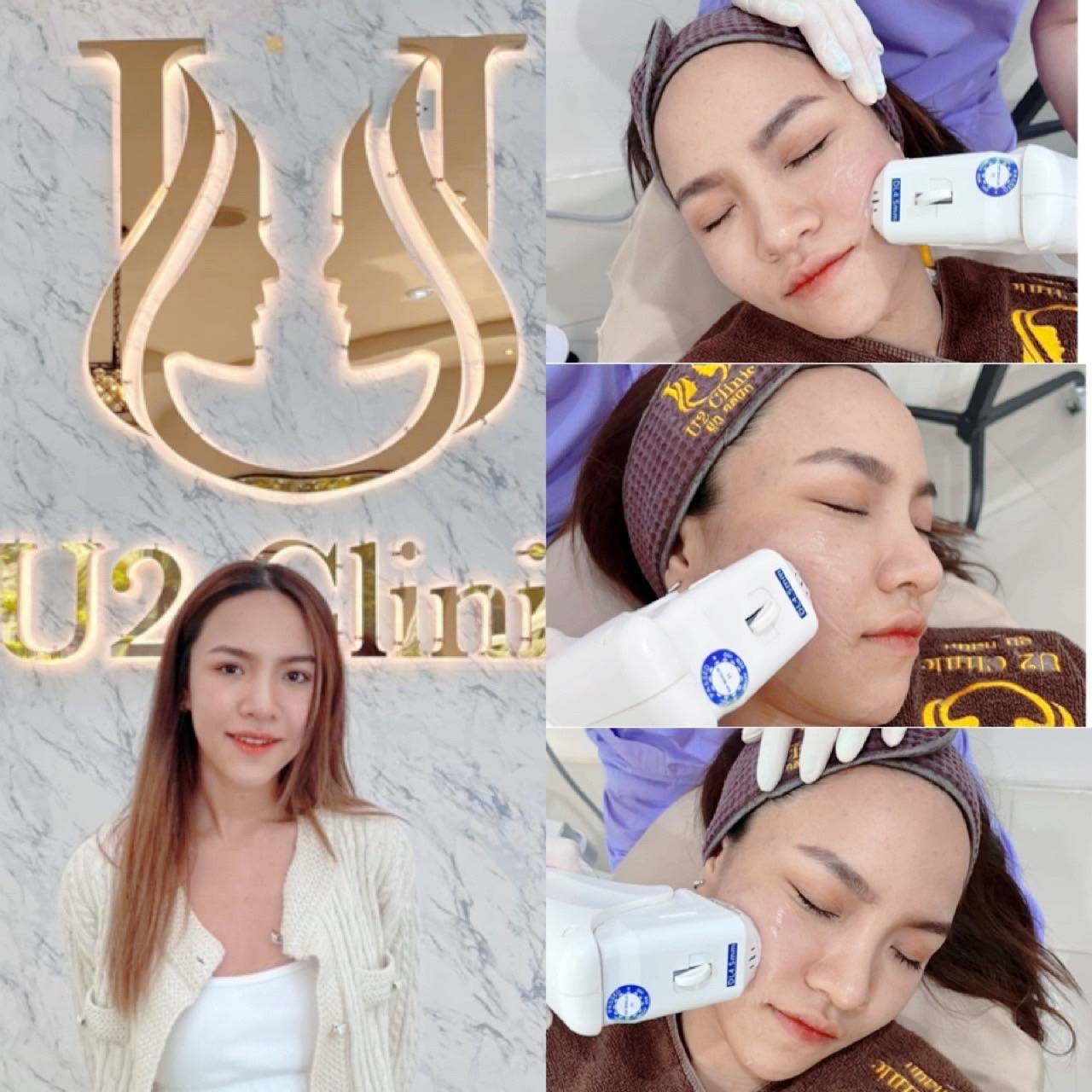 รีวิว U2clinic - ยิงไฮฟู่หลักร้อย ได้ผลลัพธ์เกินคุ้มที่ U2 Clinic