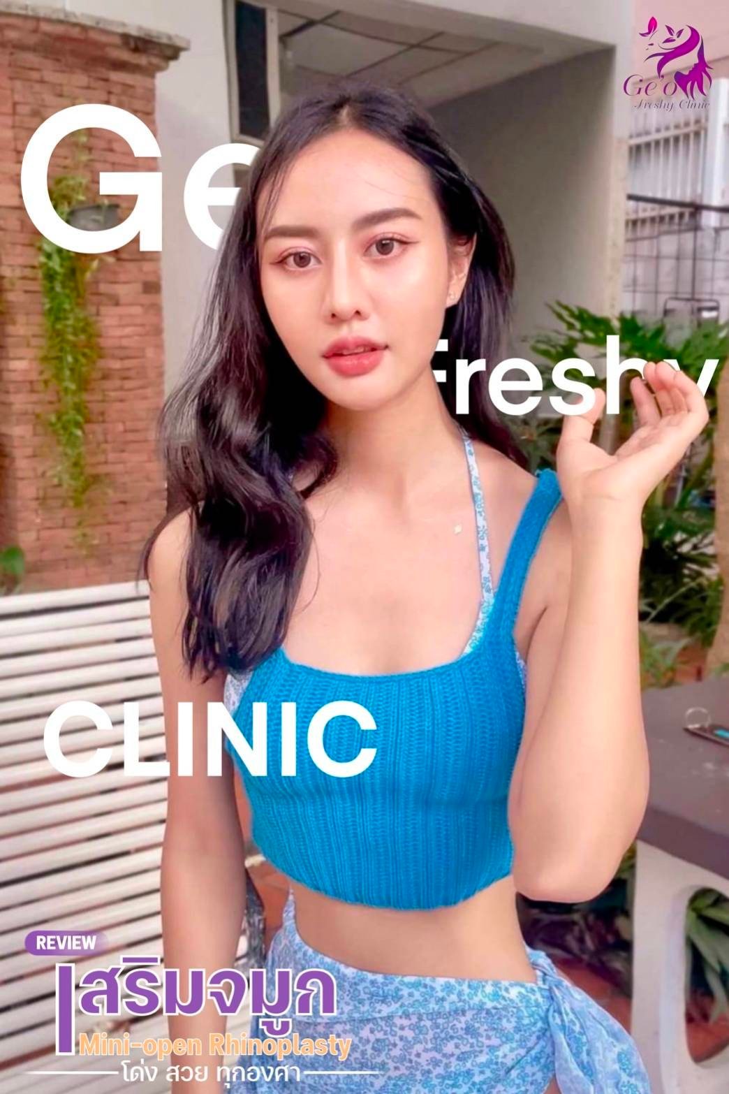 รีวิว Ge'O Freshy Clinic ฝาง - คลินิกสะอาดบริการดี พนักงานเป็นกันเองดูแลดีมากๆค่ะแนะนำเลย