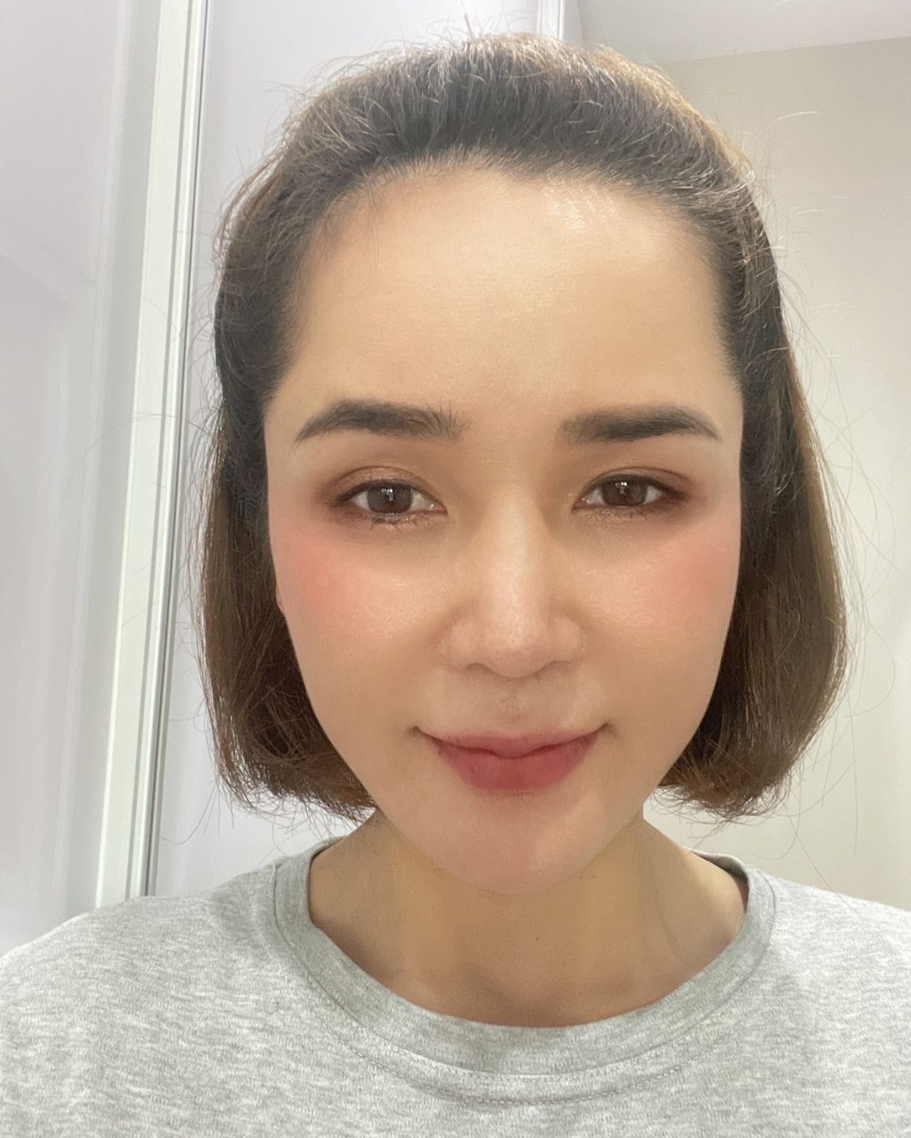 ลบริ้วรอย ยกกระชับไม่ต้องรีทัช! เทคนิคลดอายุ กับ หมอฝน Tararin Clinic - Wongnai