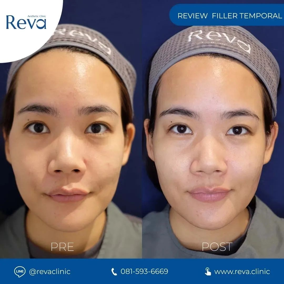 ร้าน Reva Clinic - Wongnai