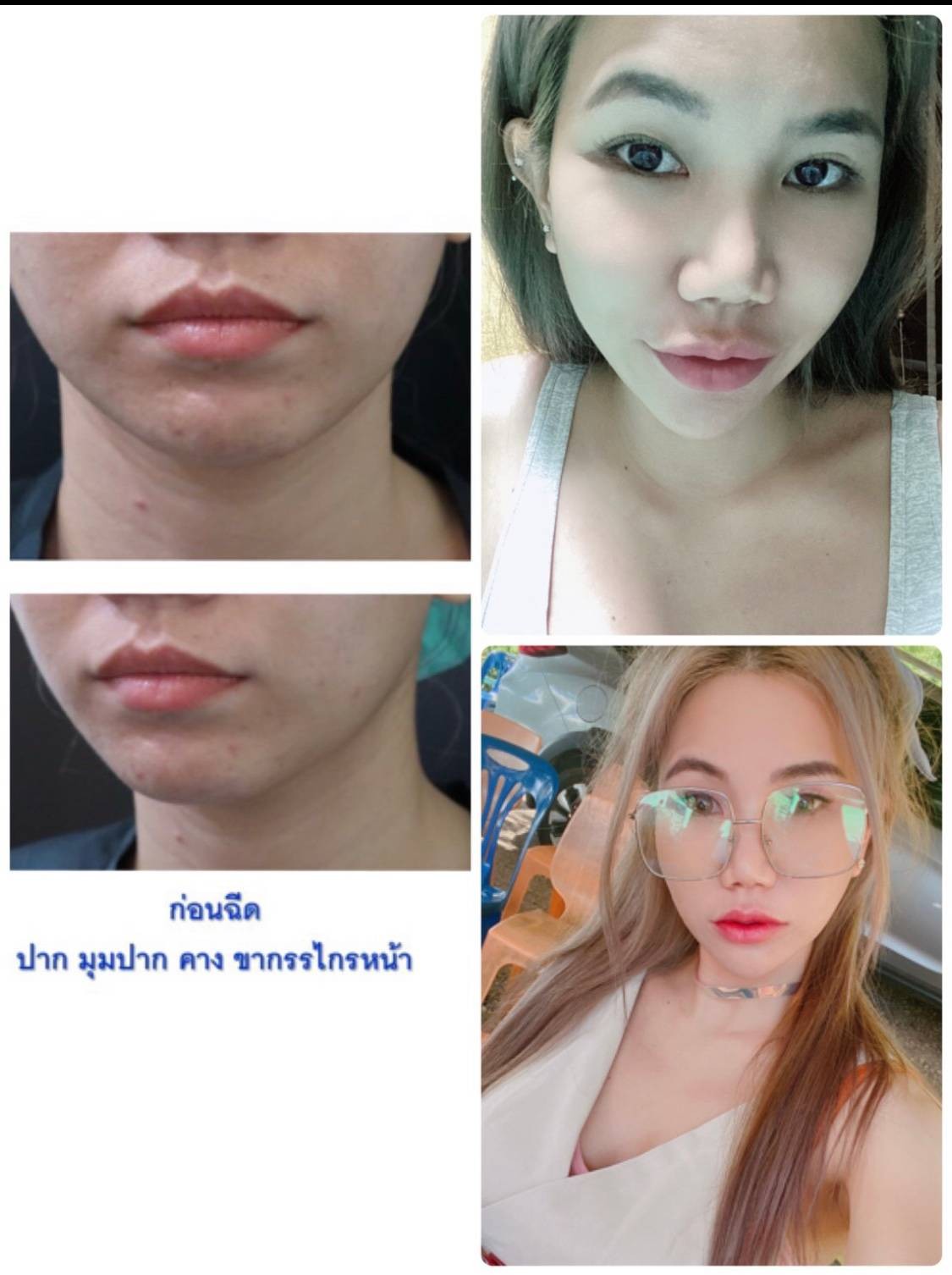 รีวิว AIC Clinic พระราม 4 - ชอบมาก พอใจมาก แนะนำที่นี่เลยคะ