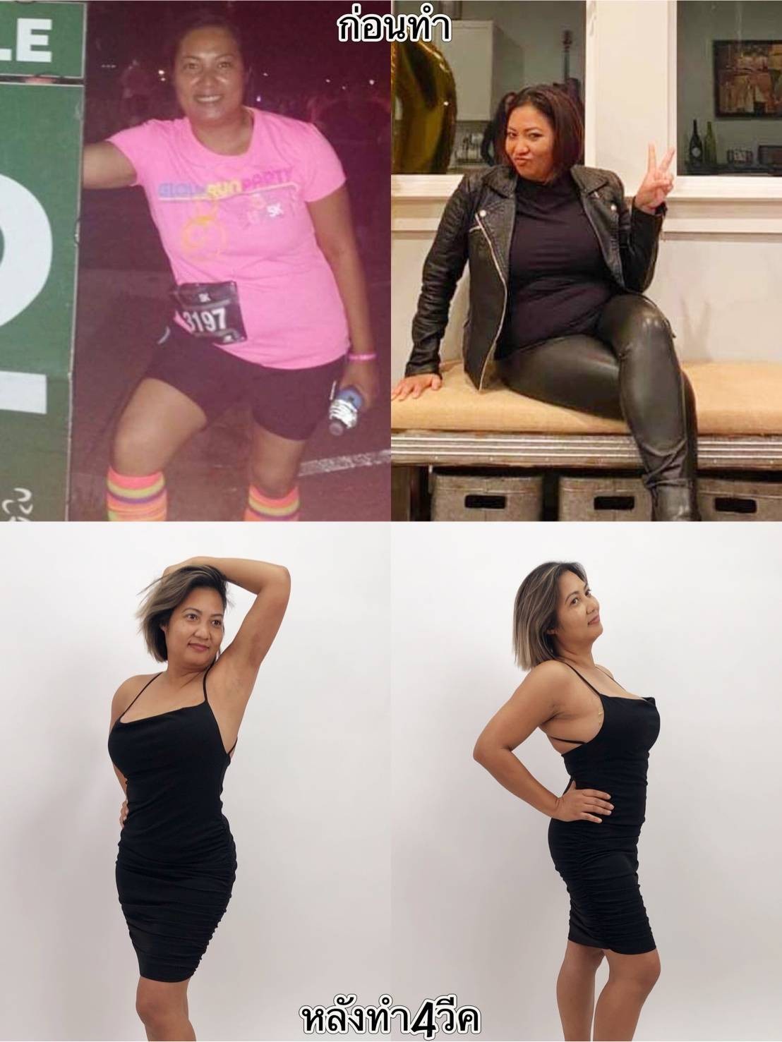 รีวิว Amara Liposuction & Body Contouring Center (Amara Clinic) รัช ...