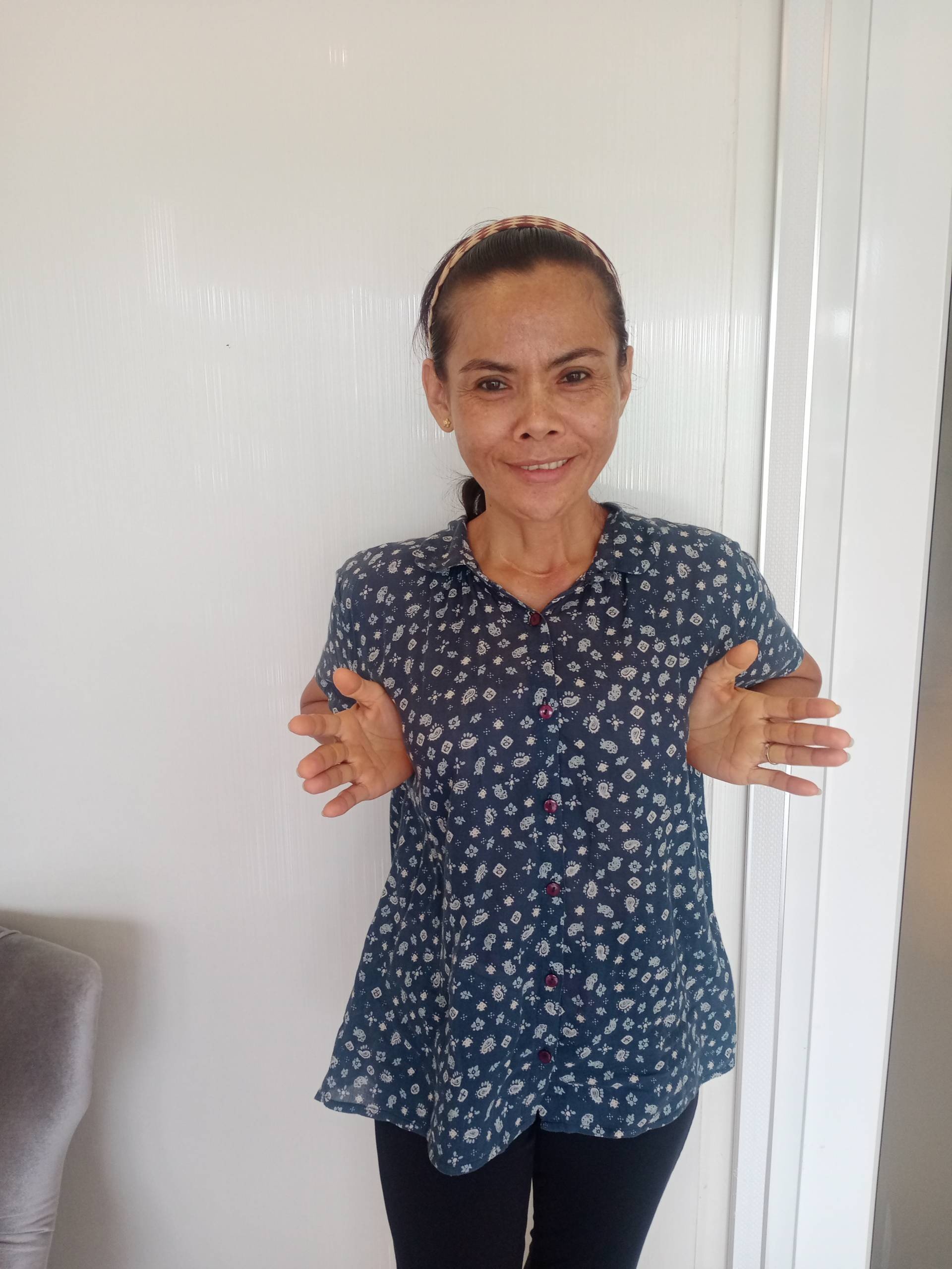 รีวิว สุรพลคลีนิคศัลยกรรม ถ.พัทยาใต้ พัทยา - เสริมหน้าอกที่นี่สุดยอดมาก ...