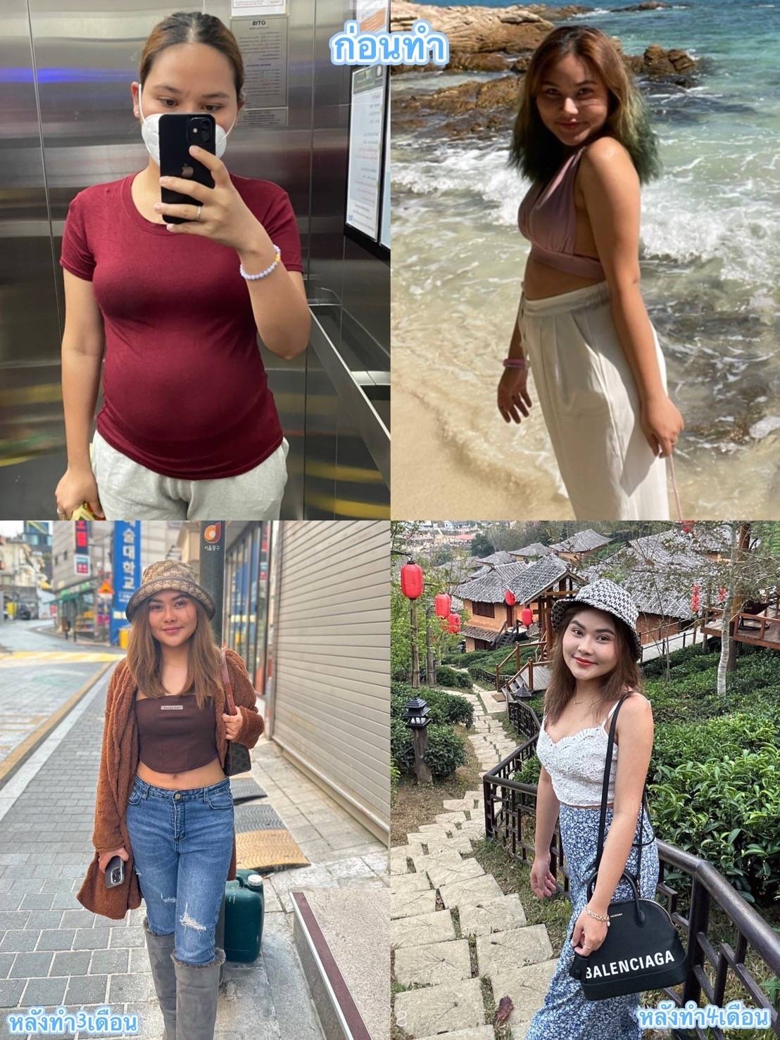 รีวิว Amara Liposuction & Body Contouring Center (Amara Clinic) รัช ...