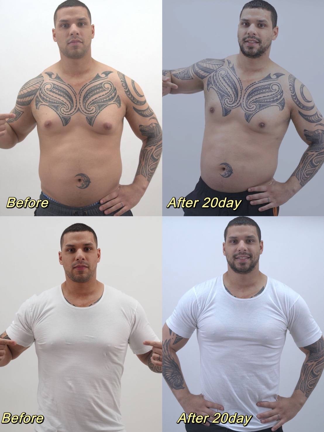 รีวิว Amara Liposuction & Body Contouring Center (Amara Clinic) รัช ...