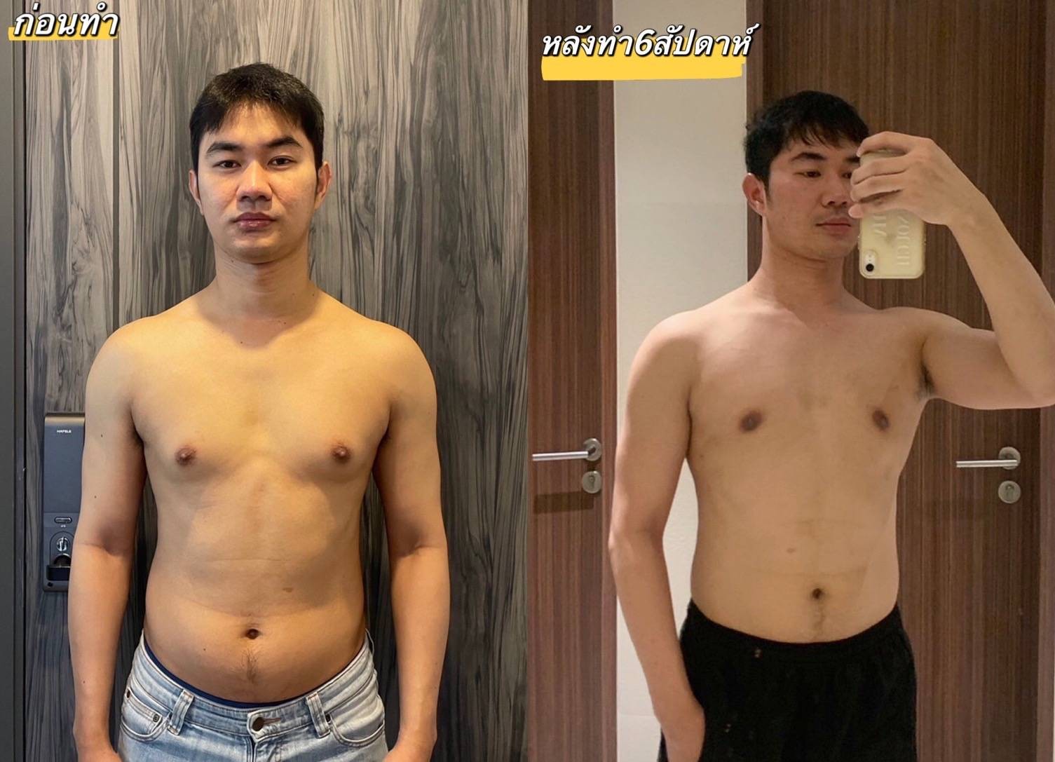 รีวิว Amara Liposuction & Body Contouring Center (Amara Clinic) รัช ...