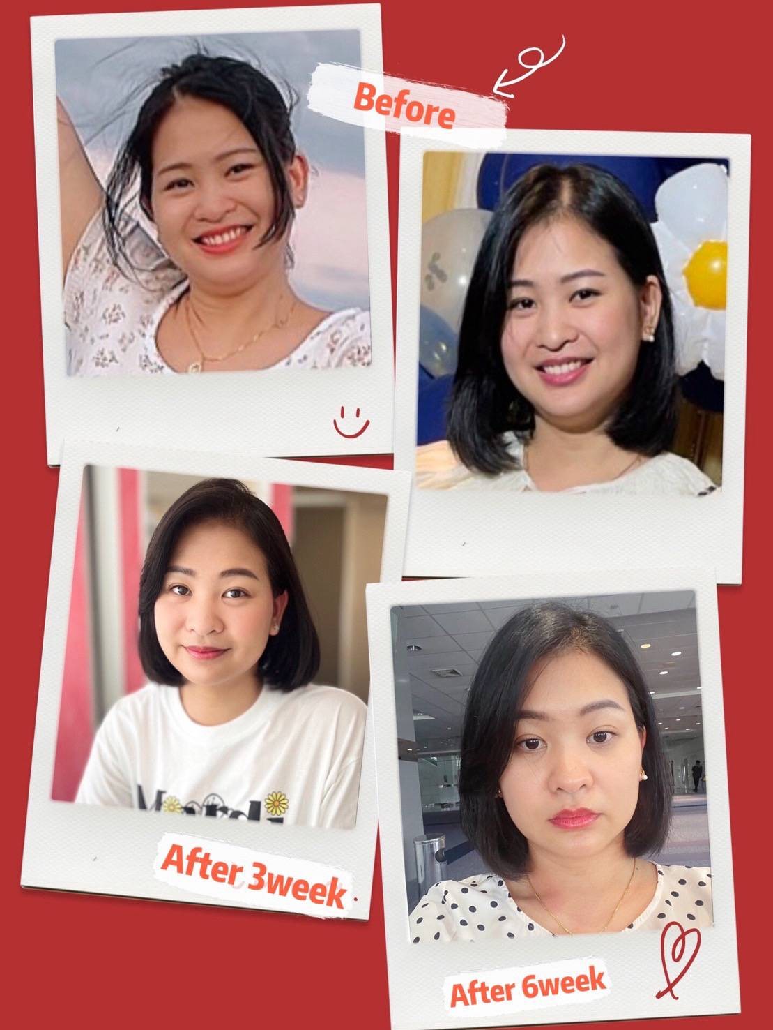 รีวิว Amara Body Surgery & Transformation รัชโยธิน, ราชพฤกษ์ - รีวิว ...