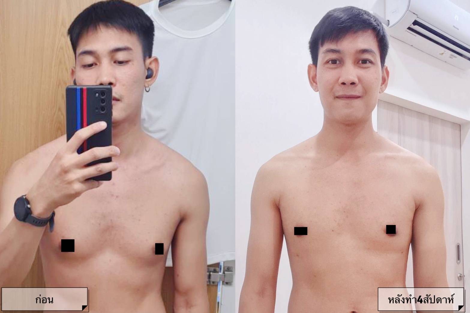 รีวิว Amara Liposuction & Body Contouring Center (Amara Clinic) รัช ...